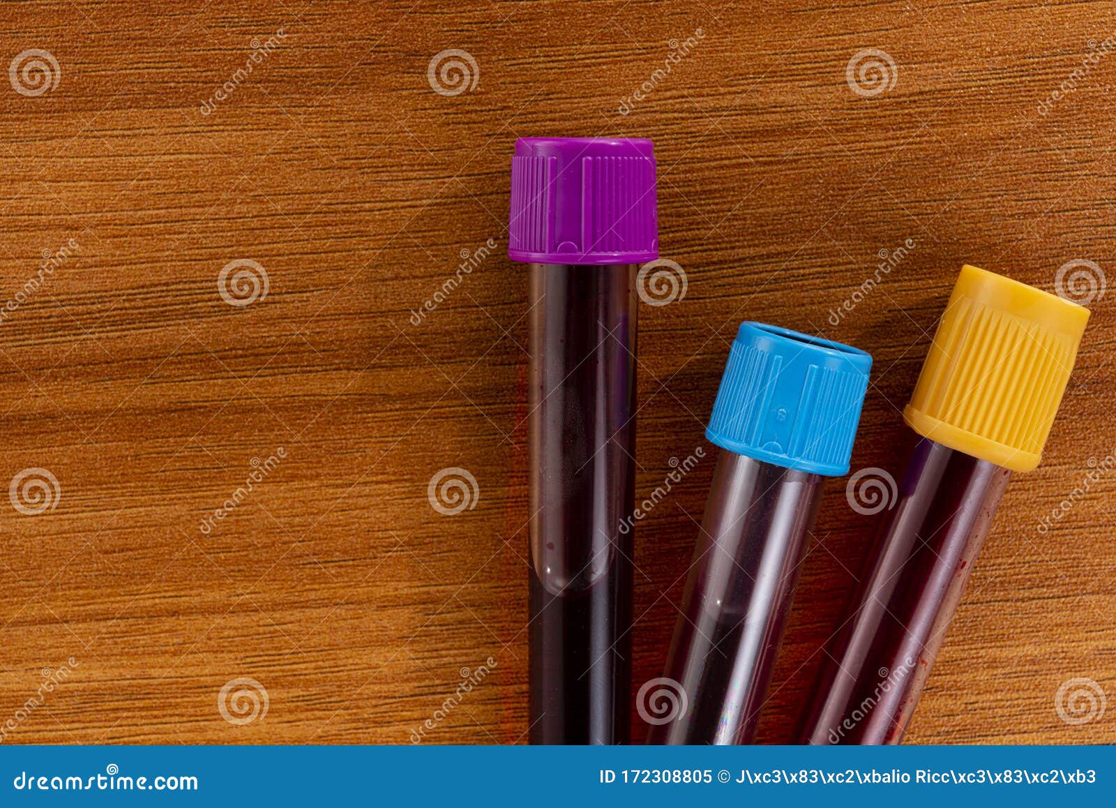 Blood Test Tubes on Wooden Table. Top View, Copy Space Stock Image ...