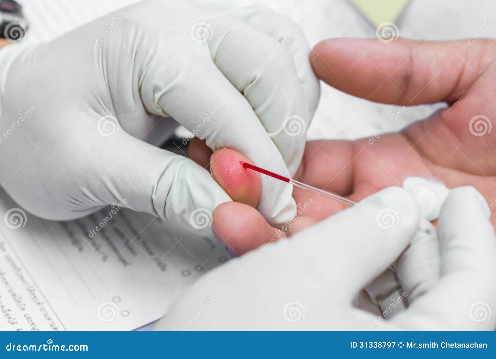 Blood testing stock image. Image of laboratory, penetrate - 31338797