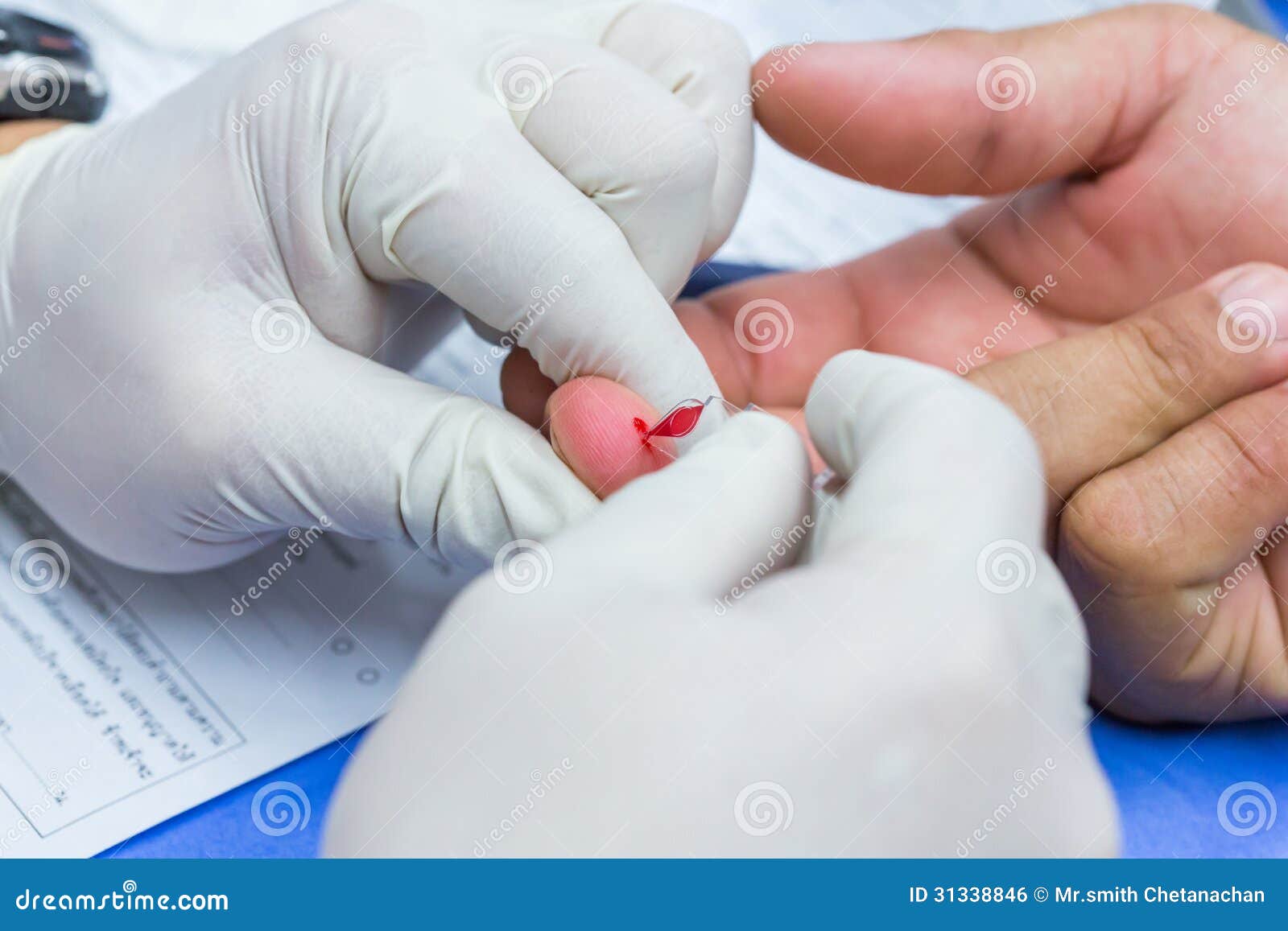 Blood testing stock photo. Image of doctor, hose, pain - 31338846