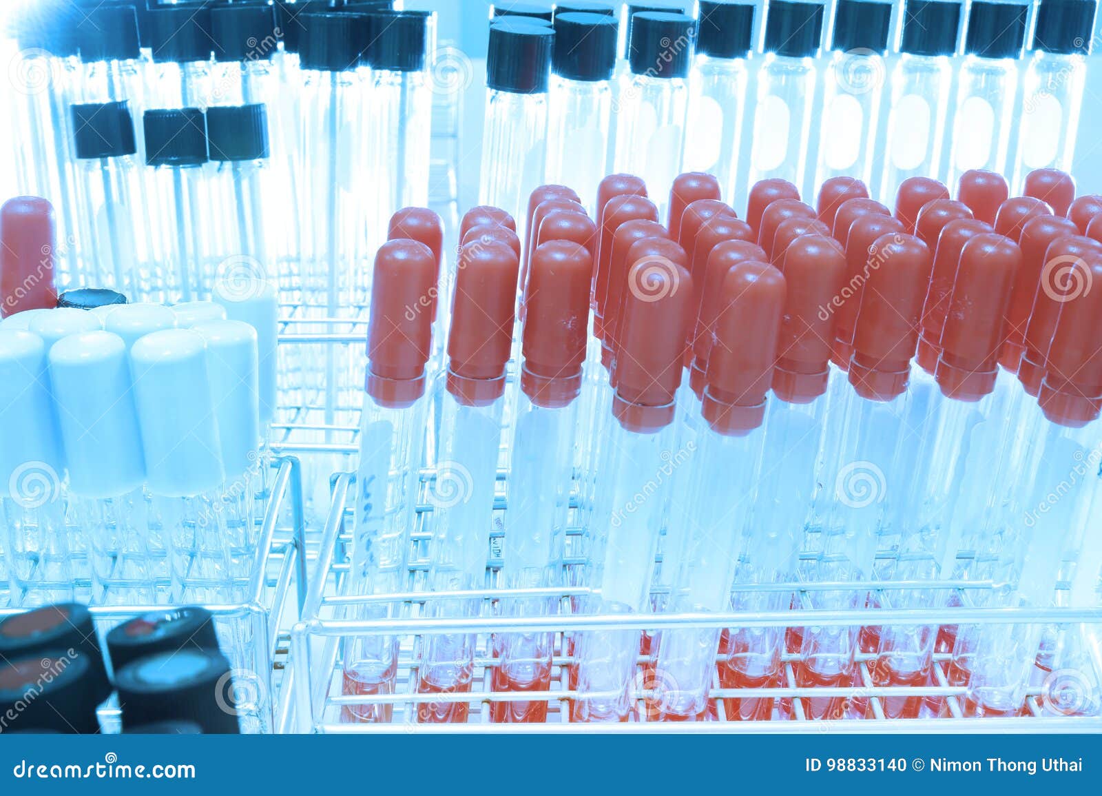 Blood Testing in Laboratory Stock Photo - Image of fingers, equipment ...