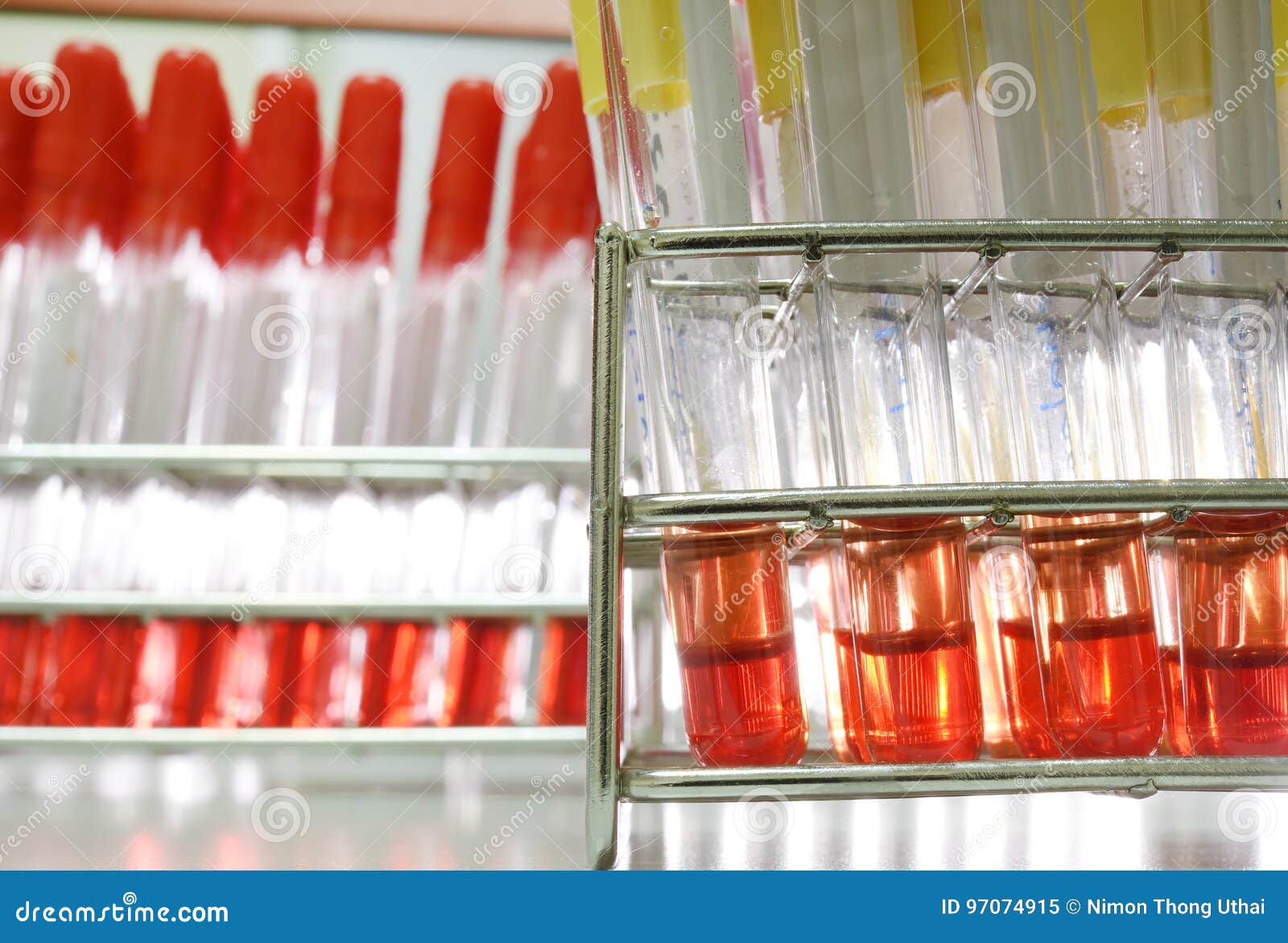 Blood Testing in Laboratory Stock Image - Image of molecular, equipment ...