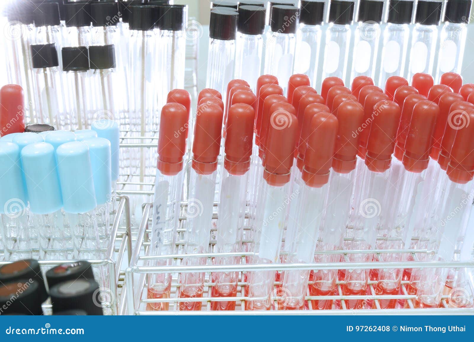 Blood Testing in Laboratory Stock Photo - Image of biologist, tool ...