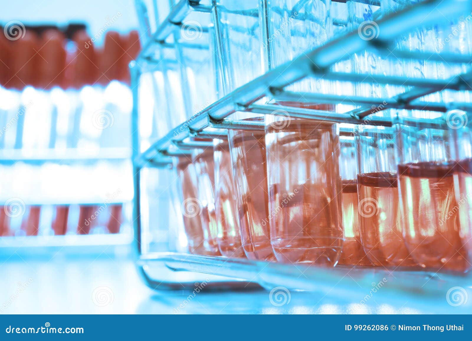 Blood Testing in Laboratory Stock Photo - Image of biology, glass: 99262086