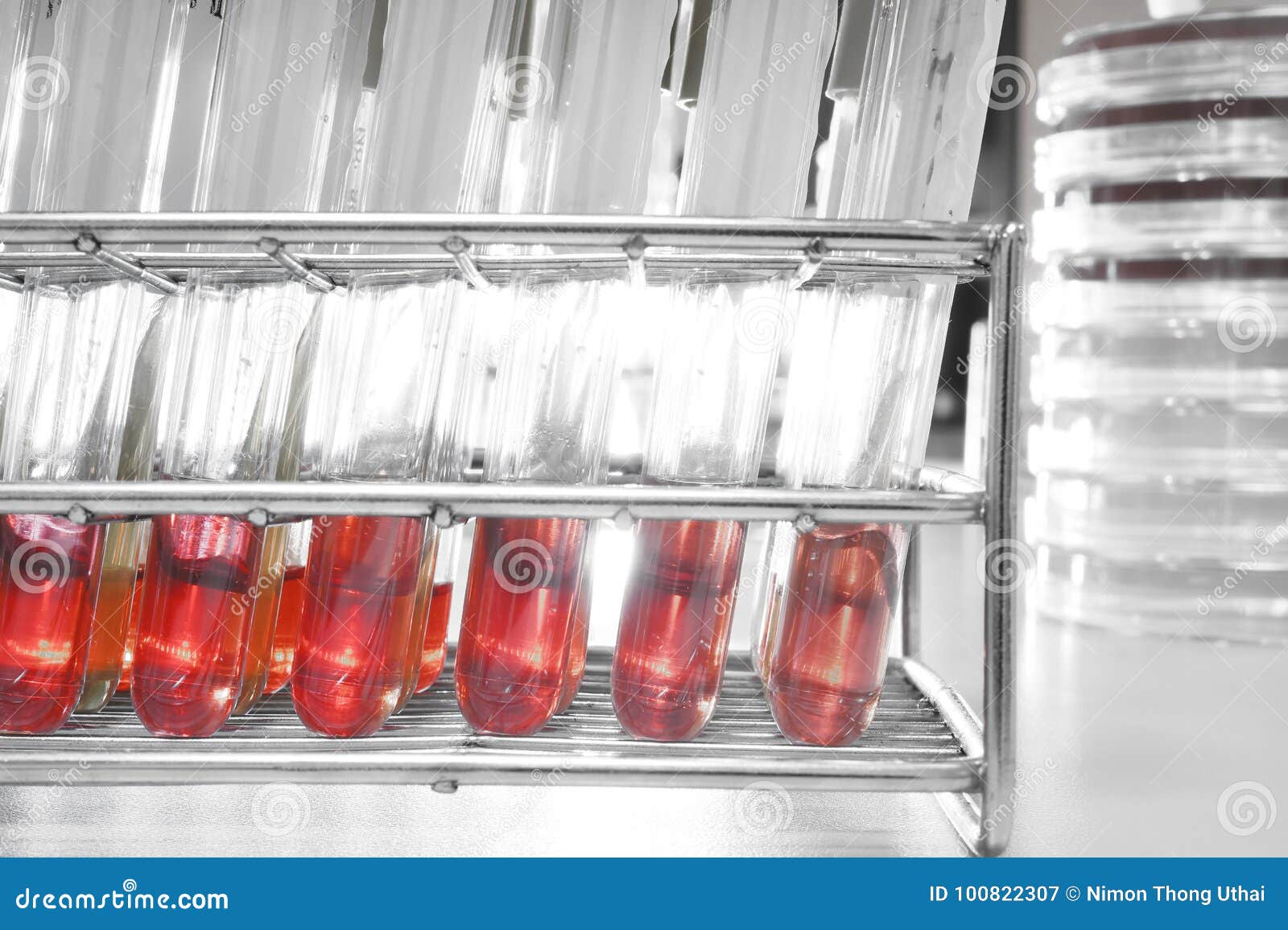 Blood Testing in Laboratory Stock Image - Image of biotechnology ...