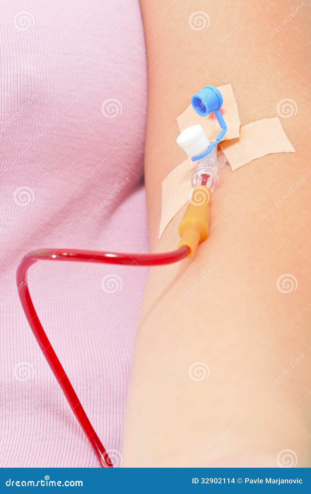 Blood transfusion stock photo. Image of illness, medical - 32902114