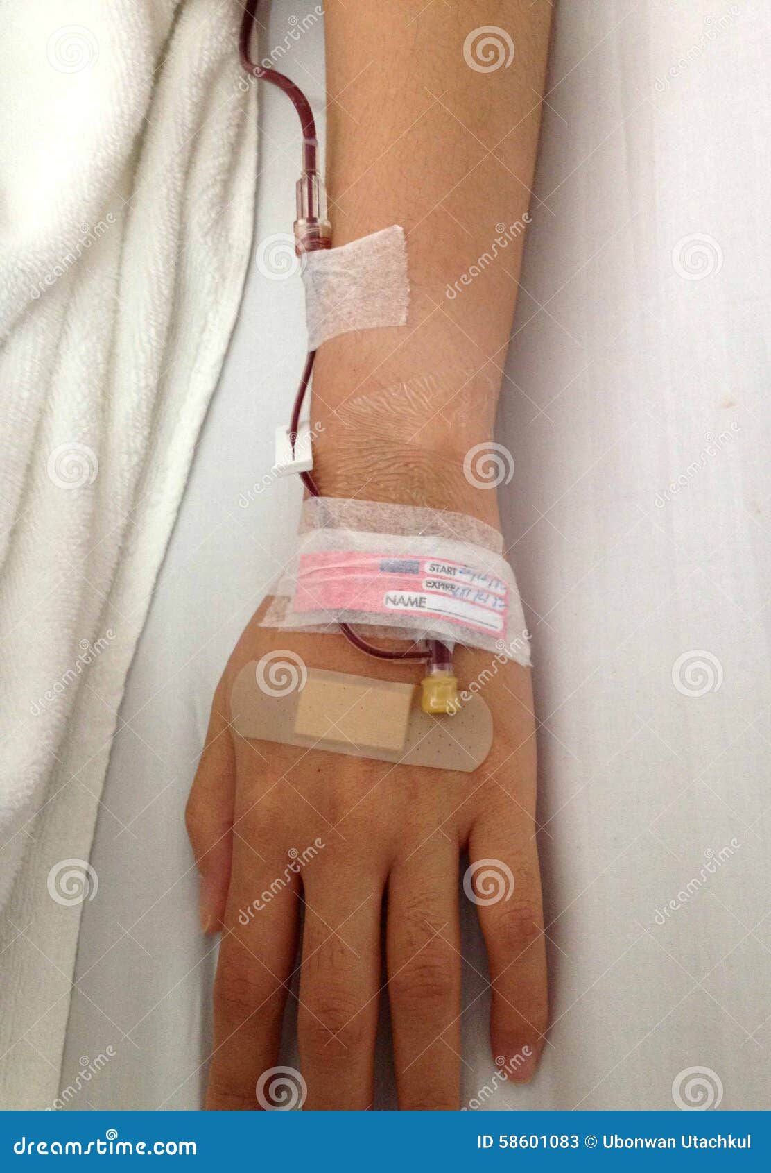Blood transfusion stock image. Image of hospital, injection - 58601083