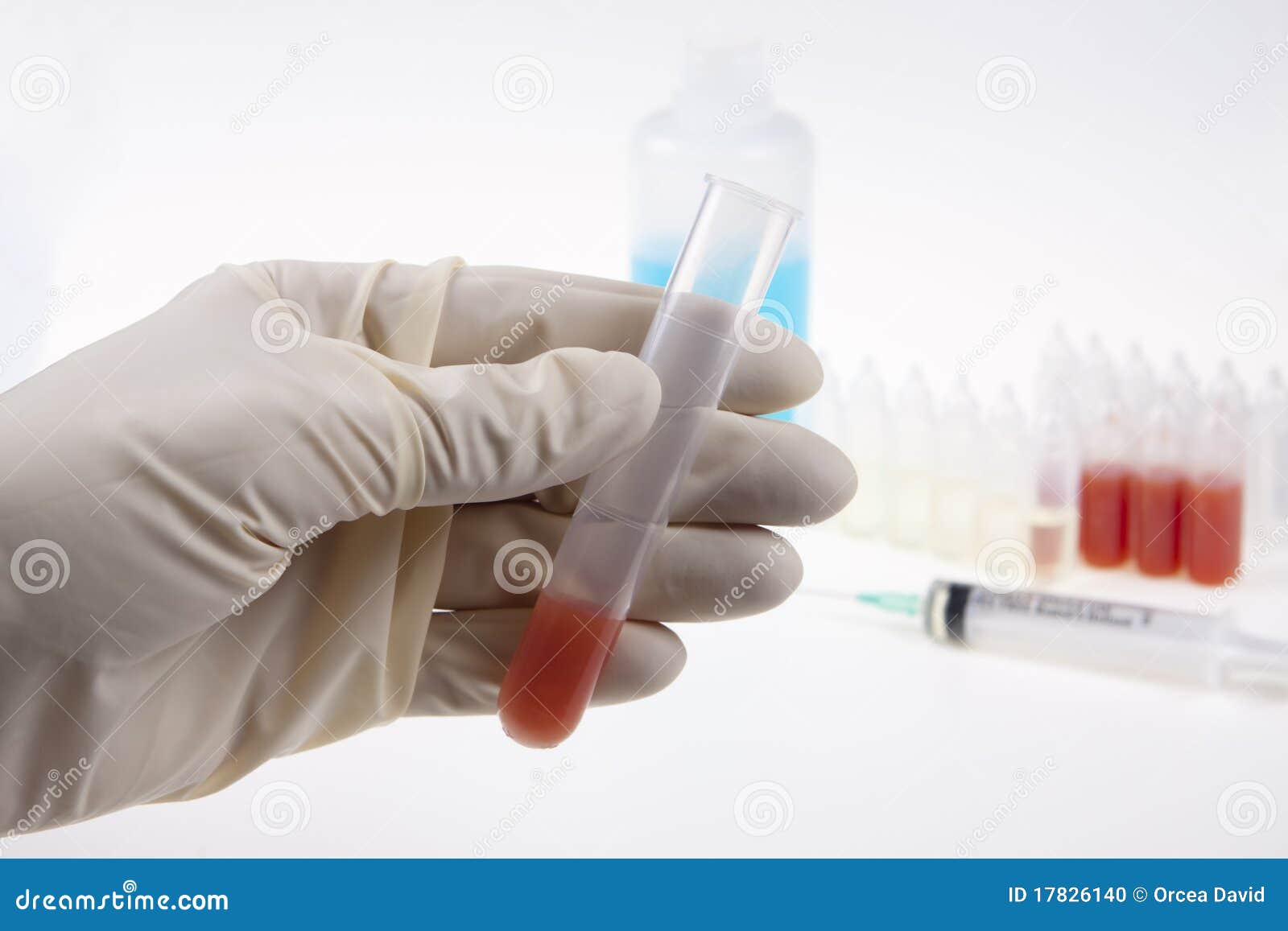 Inoculation On Blood Agar On A Culture Plate Using Inoculation Loop By ...