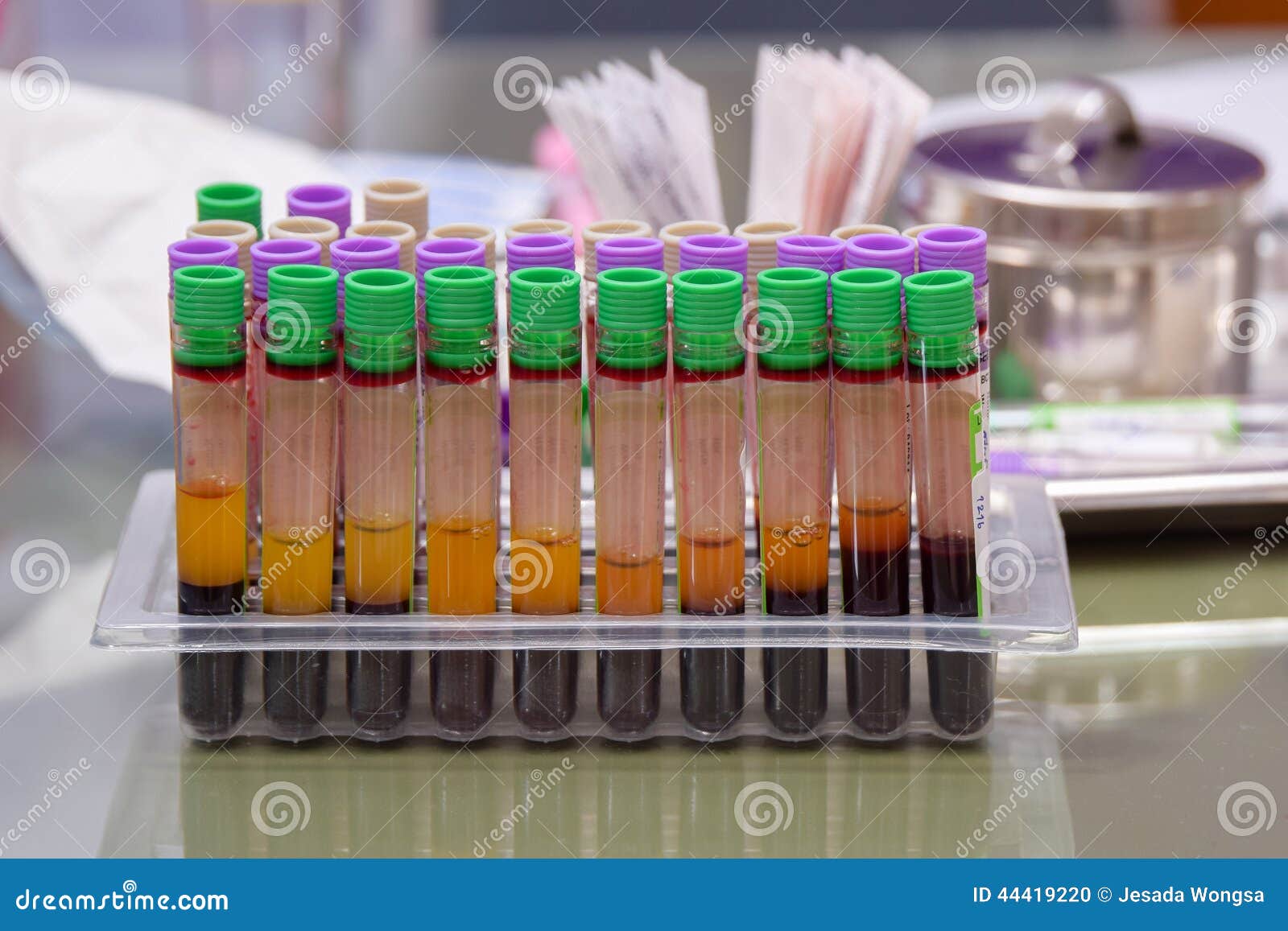 Blood Tube in Laboratory for Testing Stock Photo - Image of science ...