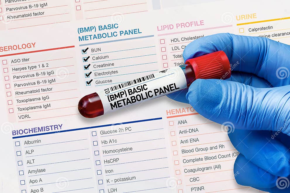 Blood Tube Test with Requisition Form for BMP Basic Metabolic Panel ...
