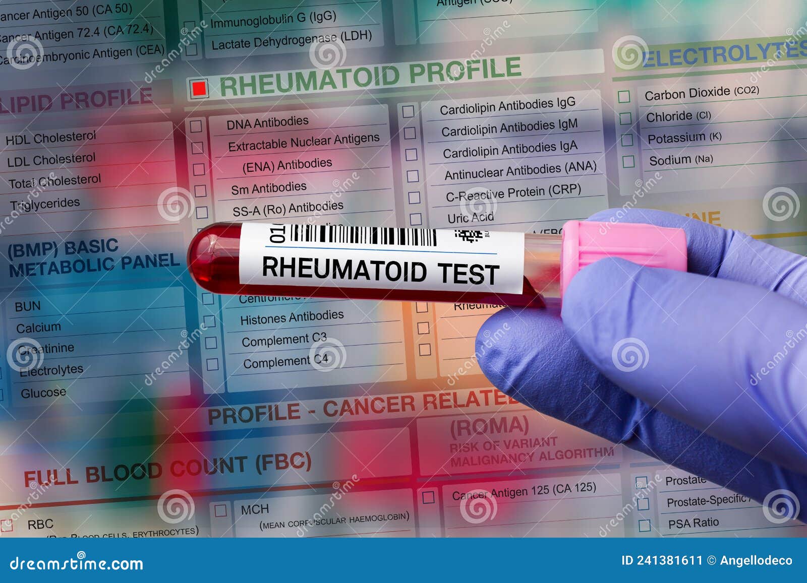 Blood Tube Test with Requisition Form for Rheumatoid Test Stock Image ...