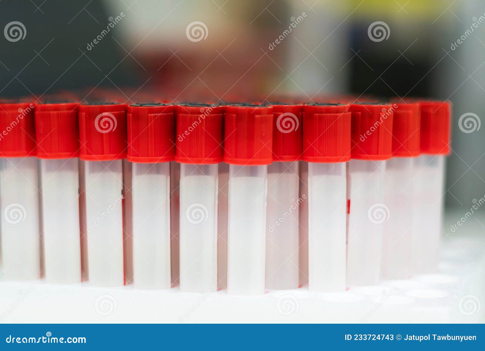 Blood Tube for Testing in a Laboratory Stock Image - Image of hospital ...