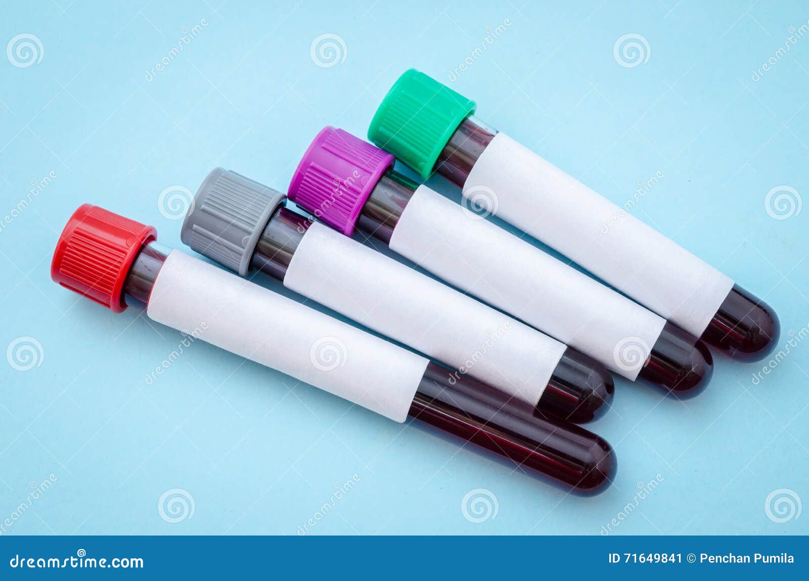 Blood Tube for Testing in Laboratory. Stock Image - Image of medicine ...