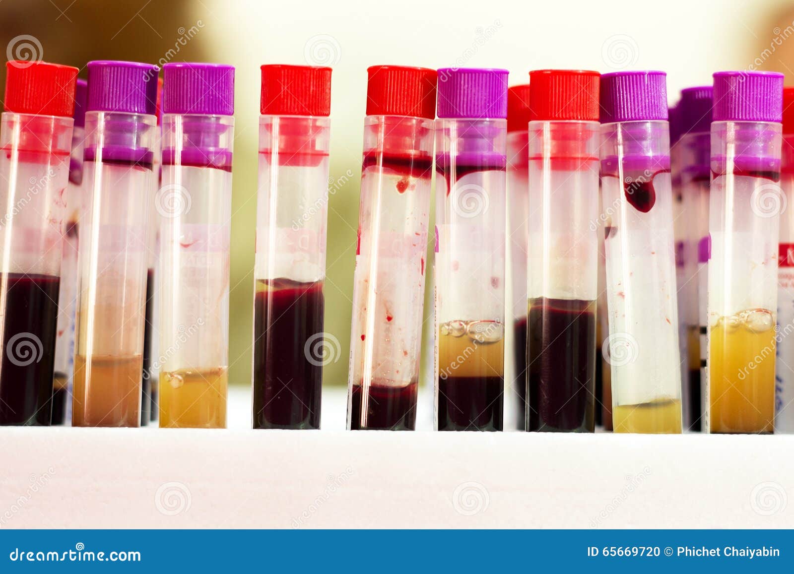 Blood tubes stock photo. Image of identification, biochemistry - 65669720