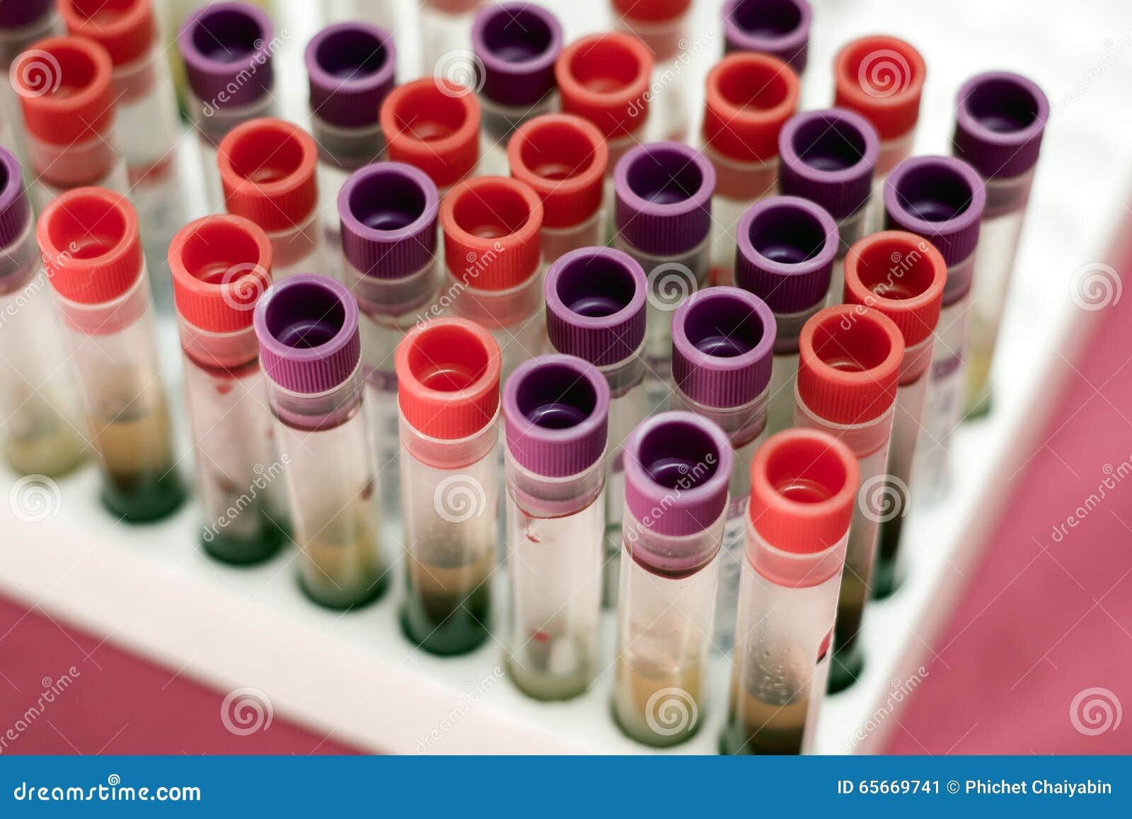 Blood tubes stock image. Image of glassware, biological - 65669741
