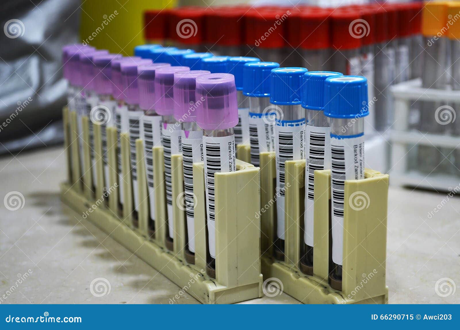 Blood Tubes With Hemodialysis Machine In The Background Royalty-Free ...