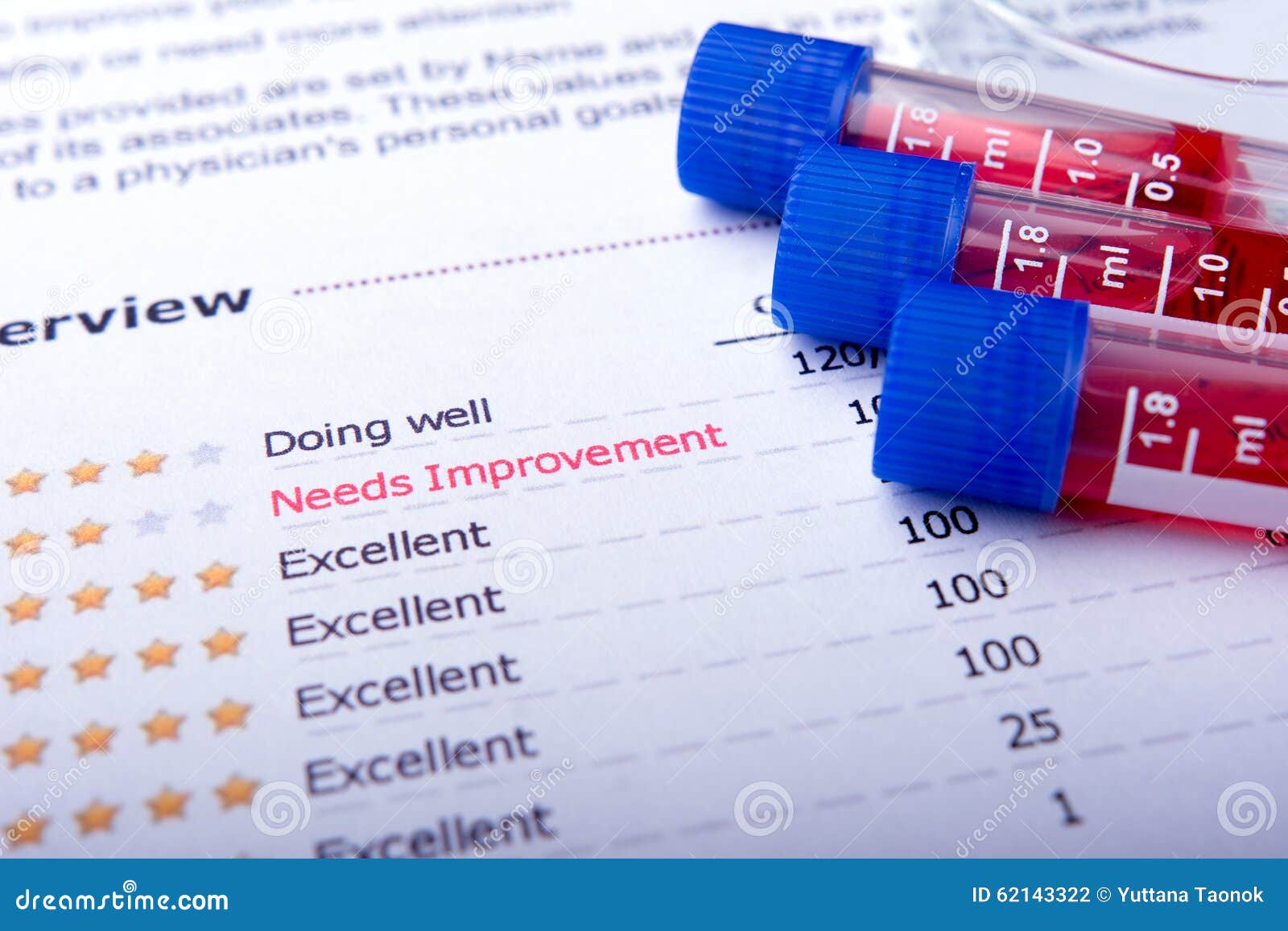 Blood in Tubes with Lab Test Result Stock Photo - Image of tubes ...