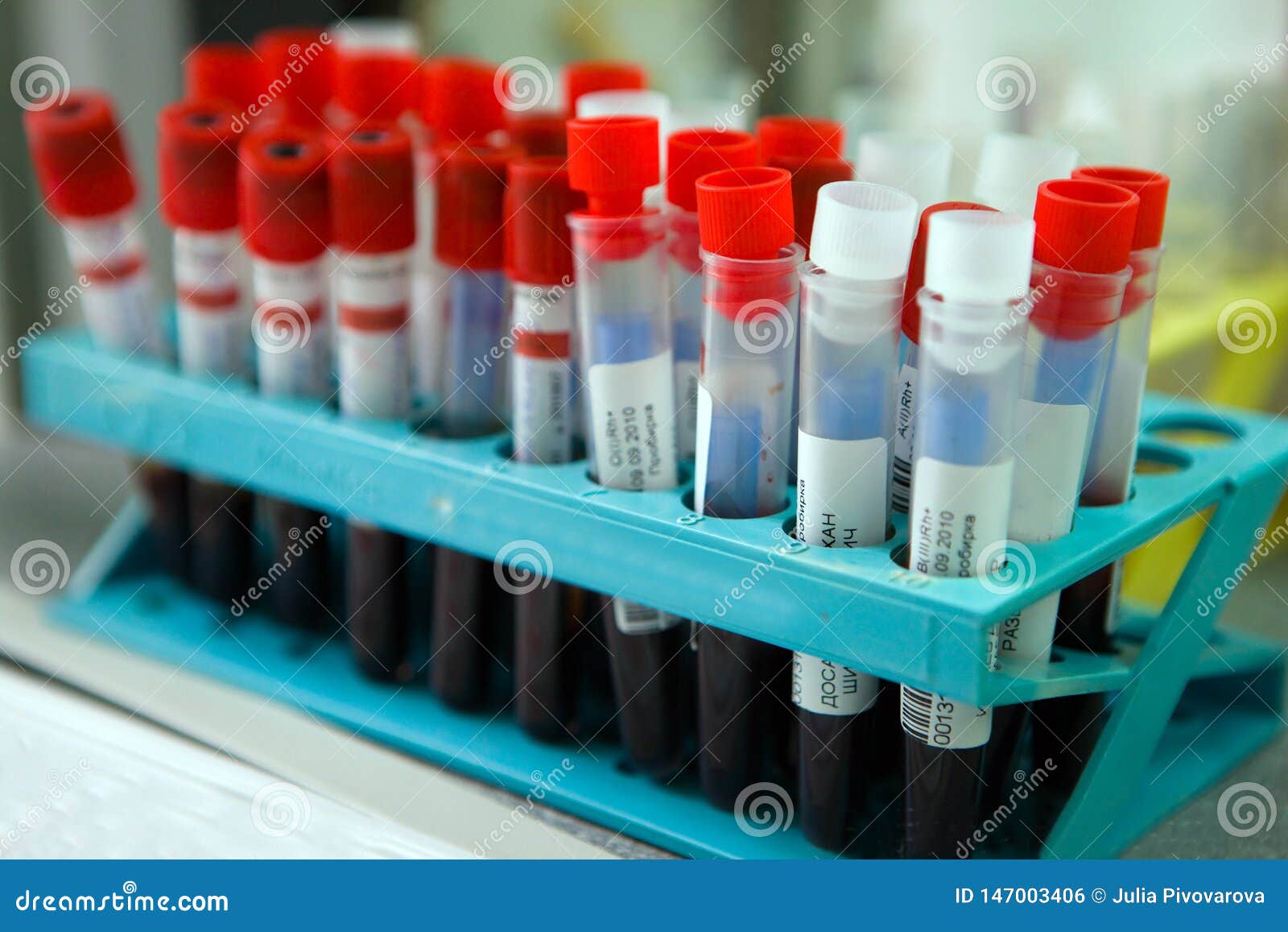 Blood Tubes in the Lab. Tests, Donation Stock Photo - Image of research ...