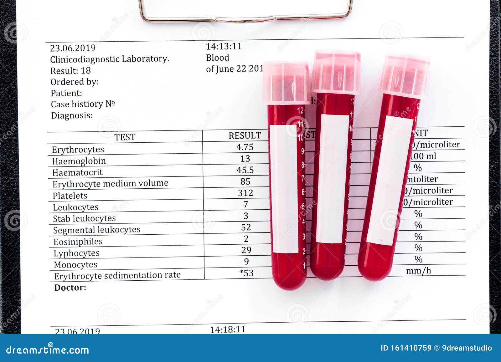 Blood Tubes on Test Results Top View Stock Image - Image of chemistry ...