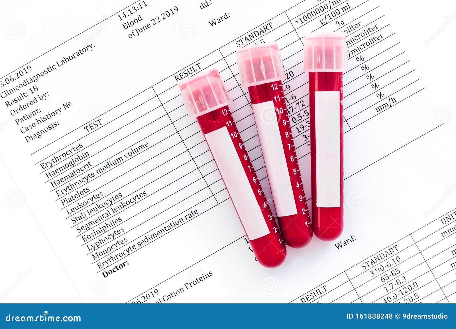 Blood Tubes on Test Results Top View Stock Photo - Image of data ...