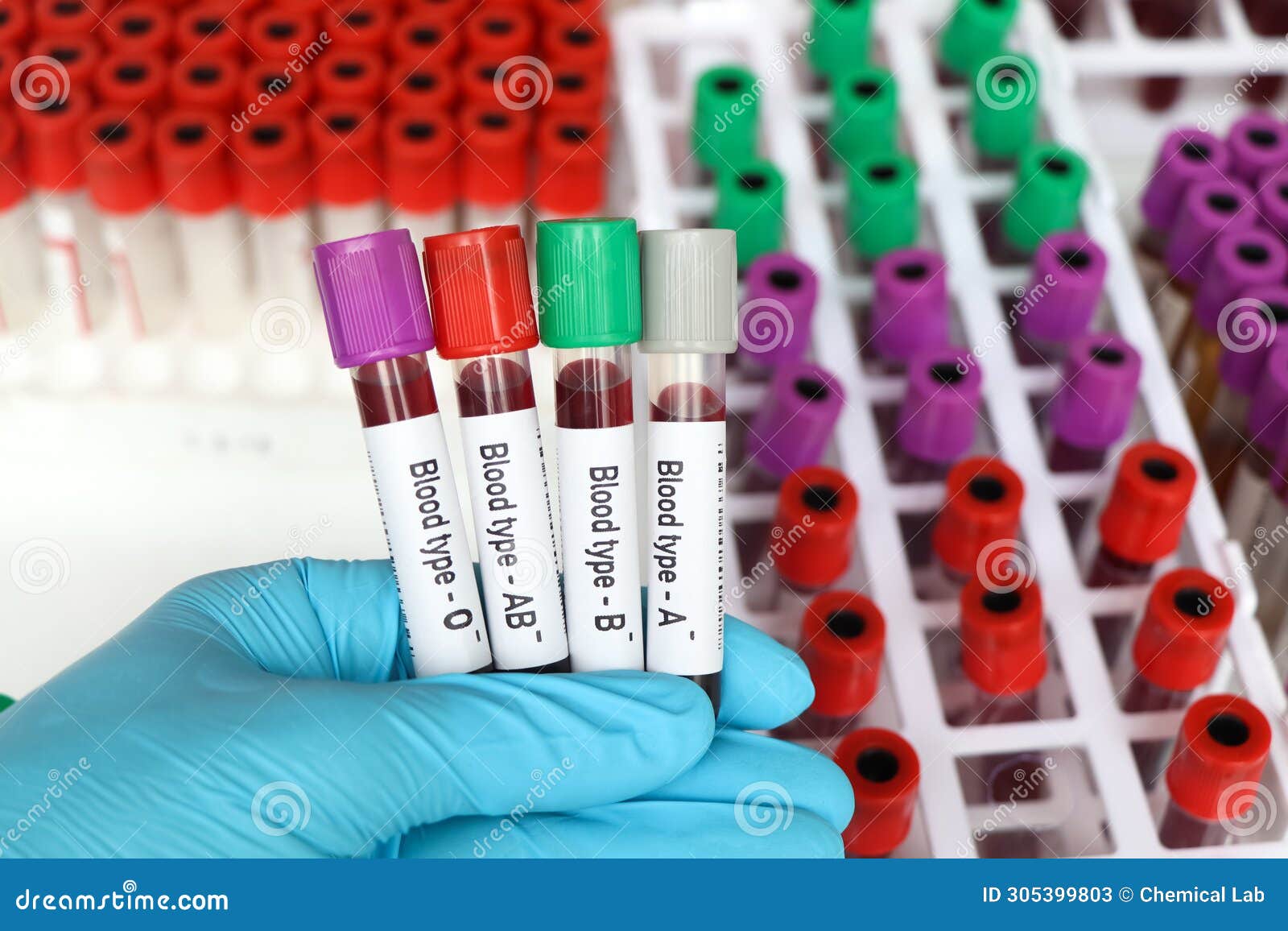 Blood Type Rh Negative Test, Blood Sample To Analyze in the Laboratory ...