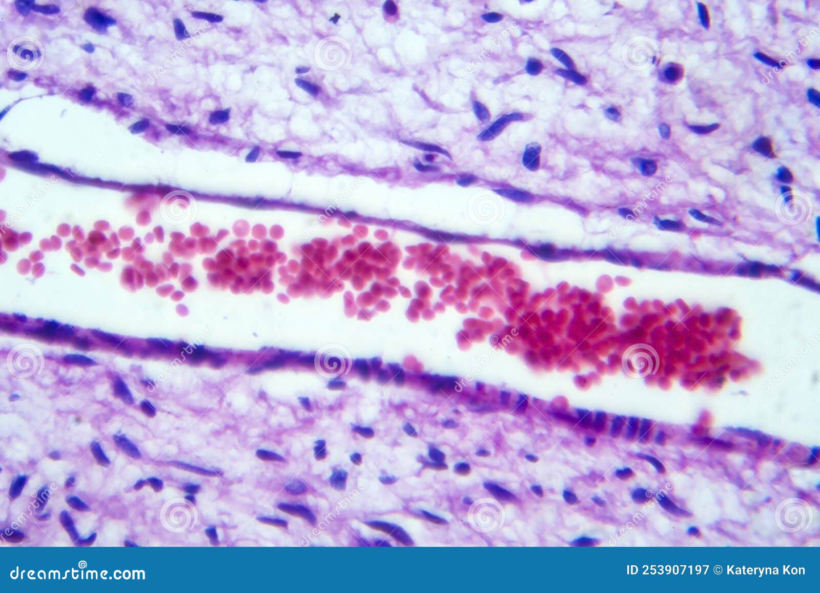 Blood Vessel with Red Blood Cells, Light Micrograph Stock Image - Image ...