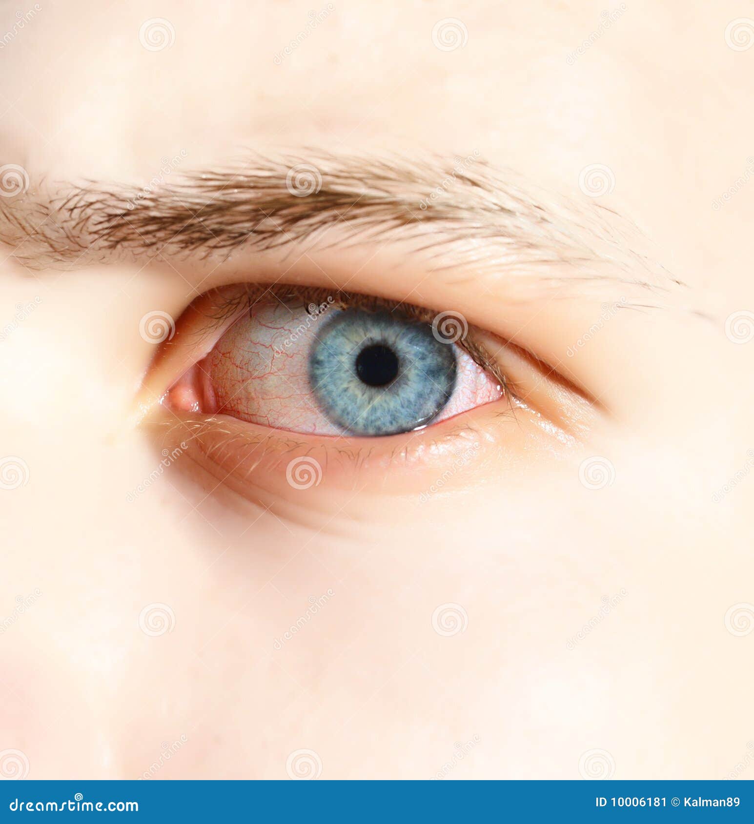 Bloody eye stock image. Image of horror, miserable, redness - 10006181