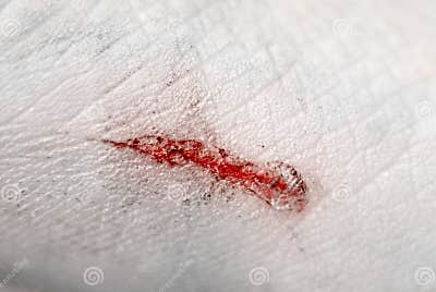 Bloody scratch closeup stock photo. Image of human, white - 5672304