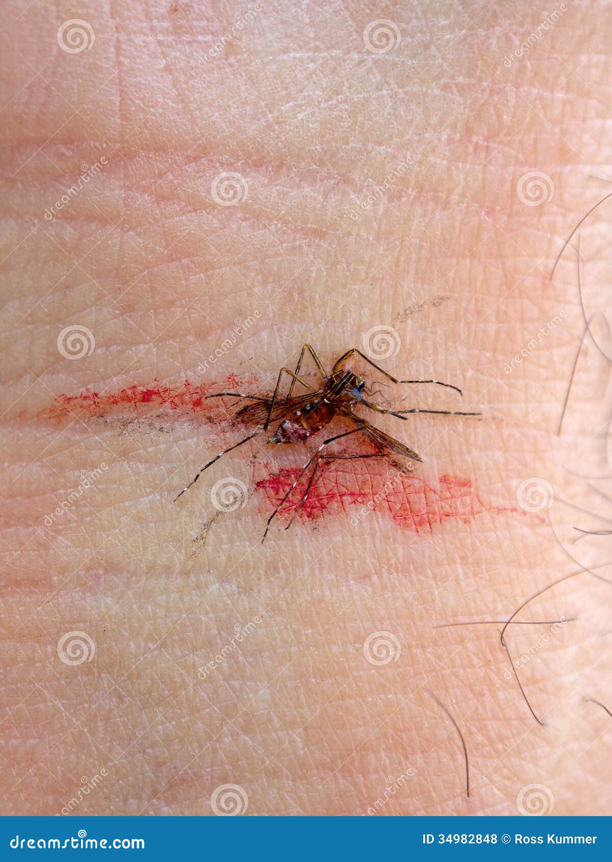 Bloody thing is squashed stock photo. Image of bite, disease - 34982848