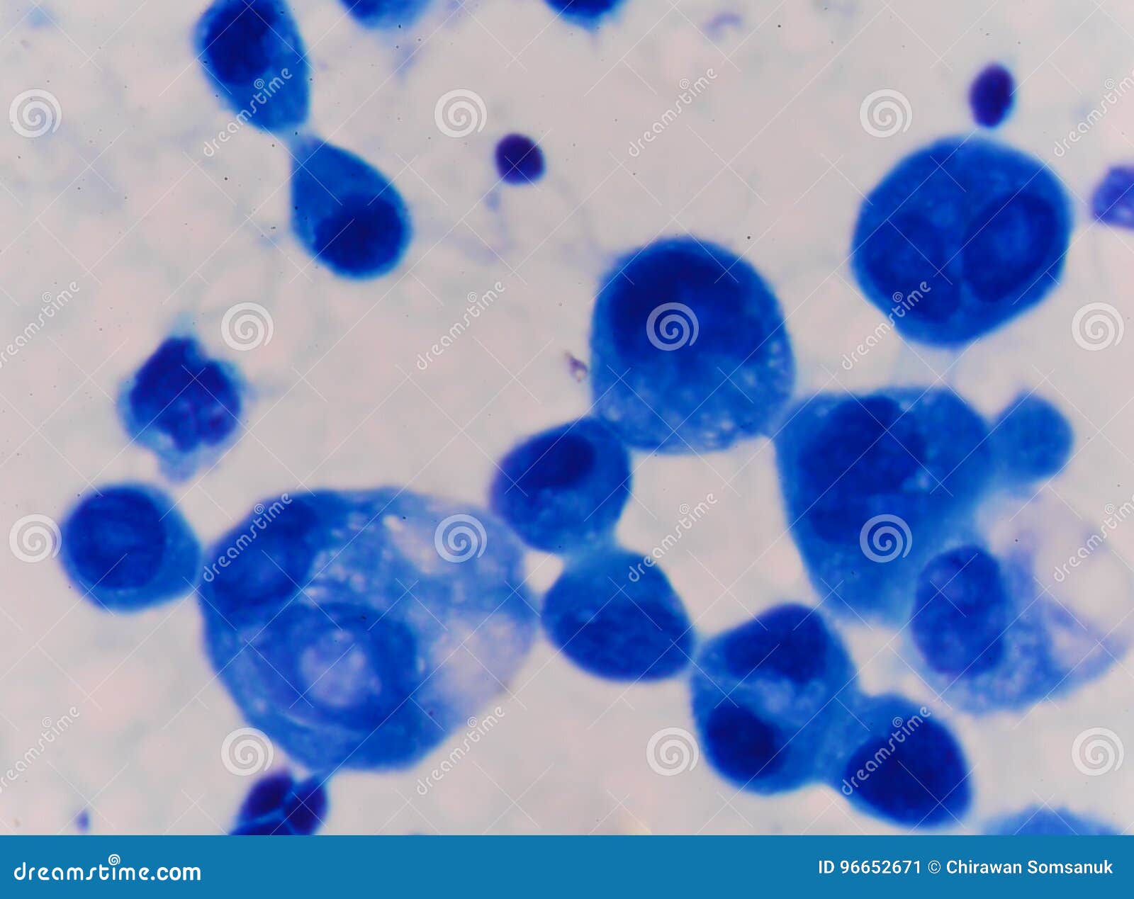 Blue cell with blue stain. stock image. Image of biology - 96652671