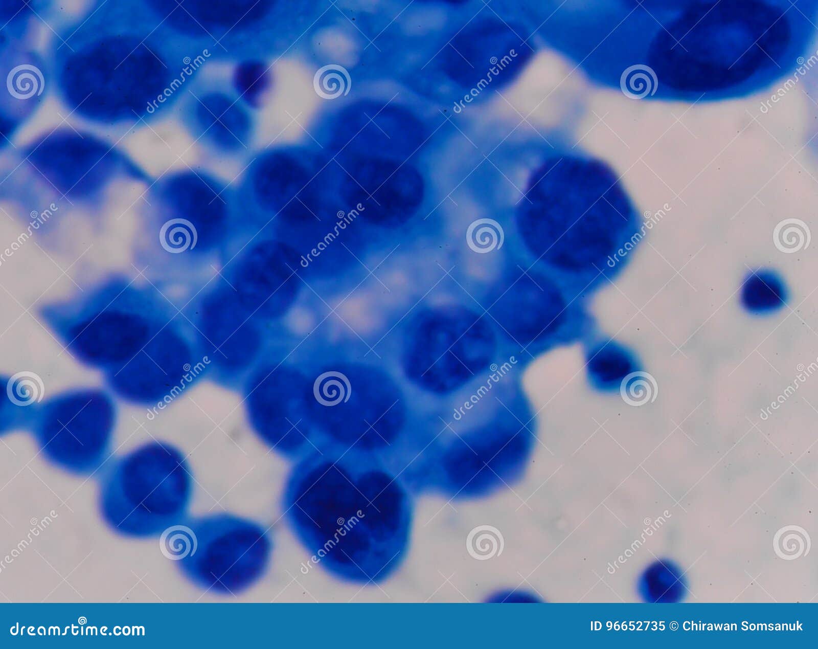 Blue cell with blue stain. stock image. Image of cells - 96652735