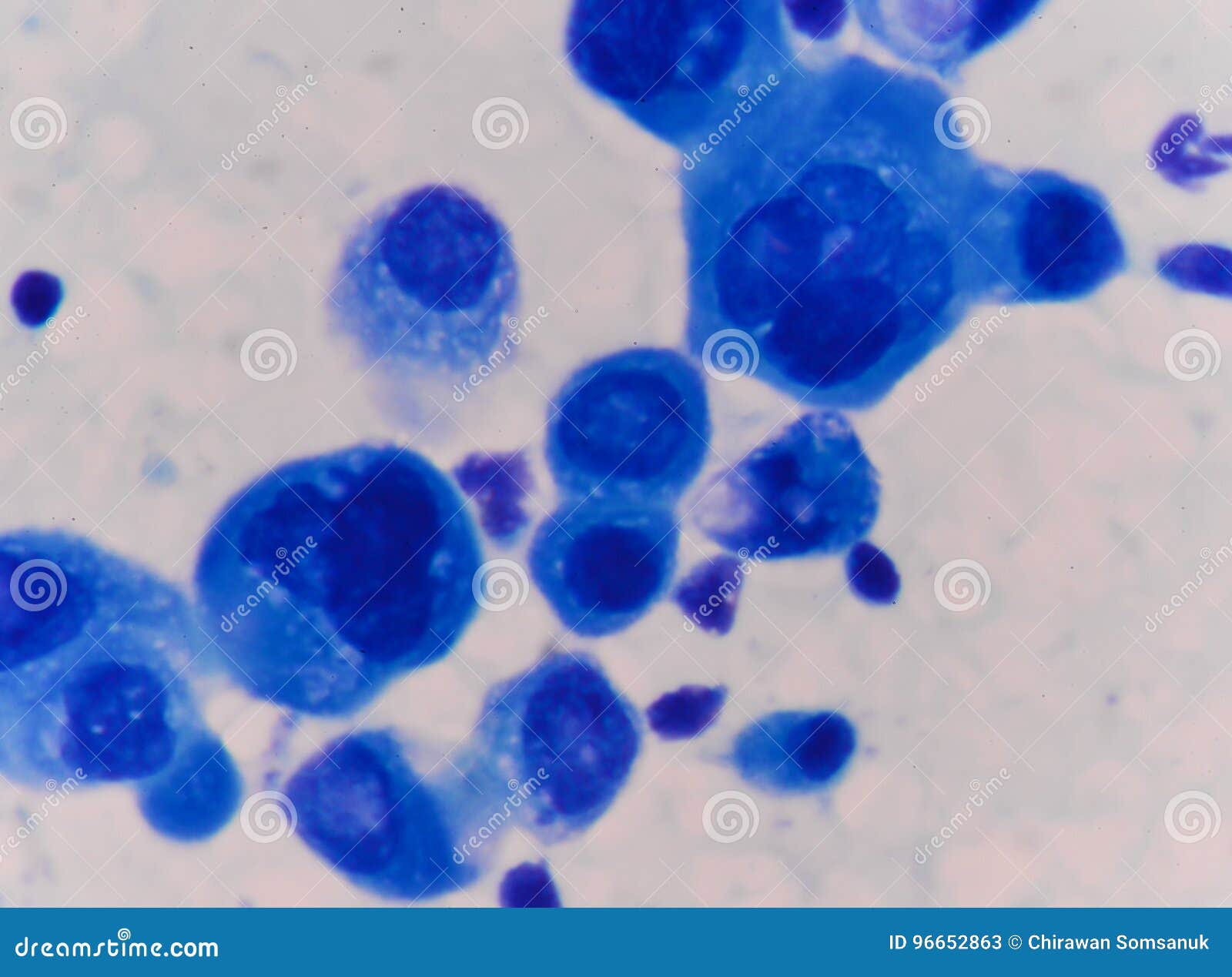 Blue cell with blue stain. stock image. Image of healthcare - 96652863