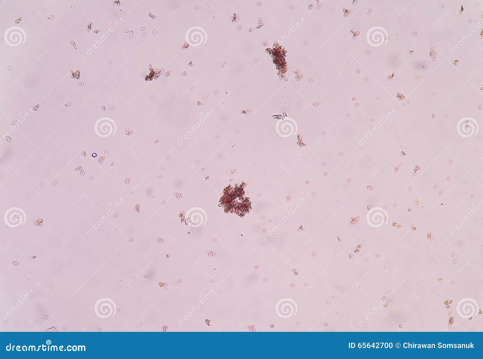Blue cells stock photo. Image of lens, health, infection - 65642700