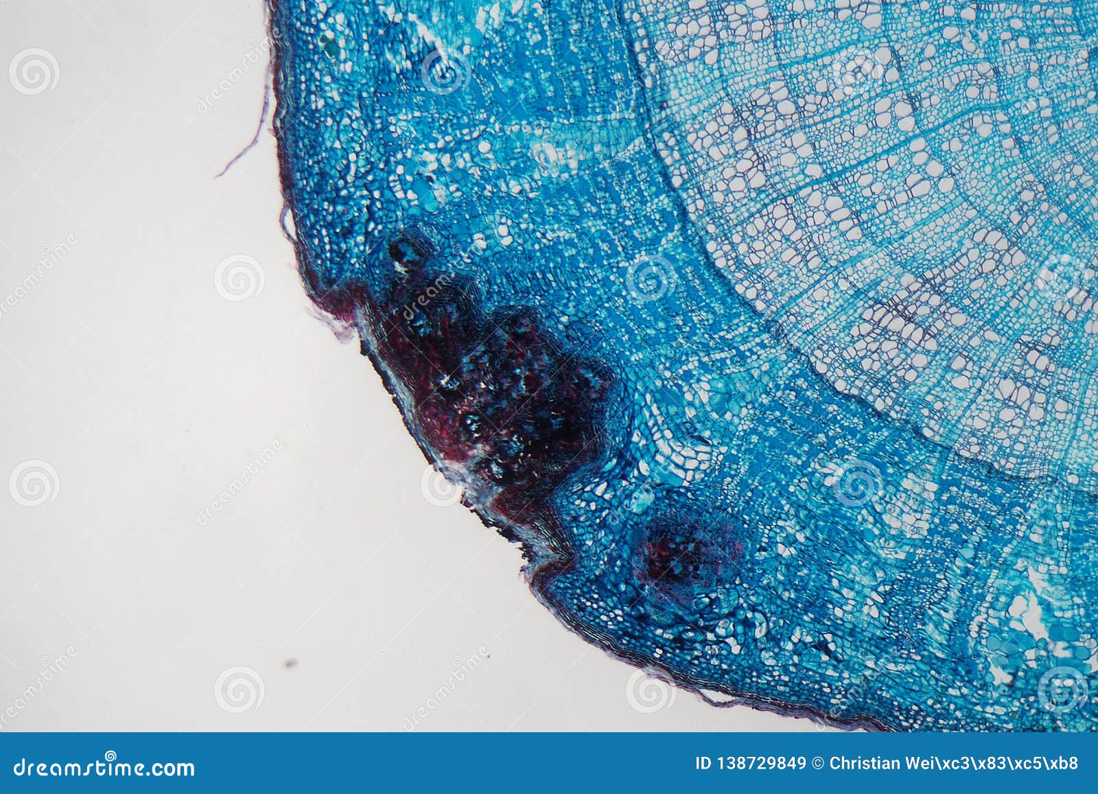 Cells of a Plant Stem with a Disease Under a Microscope Stock Image ...