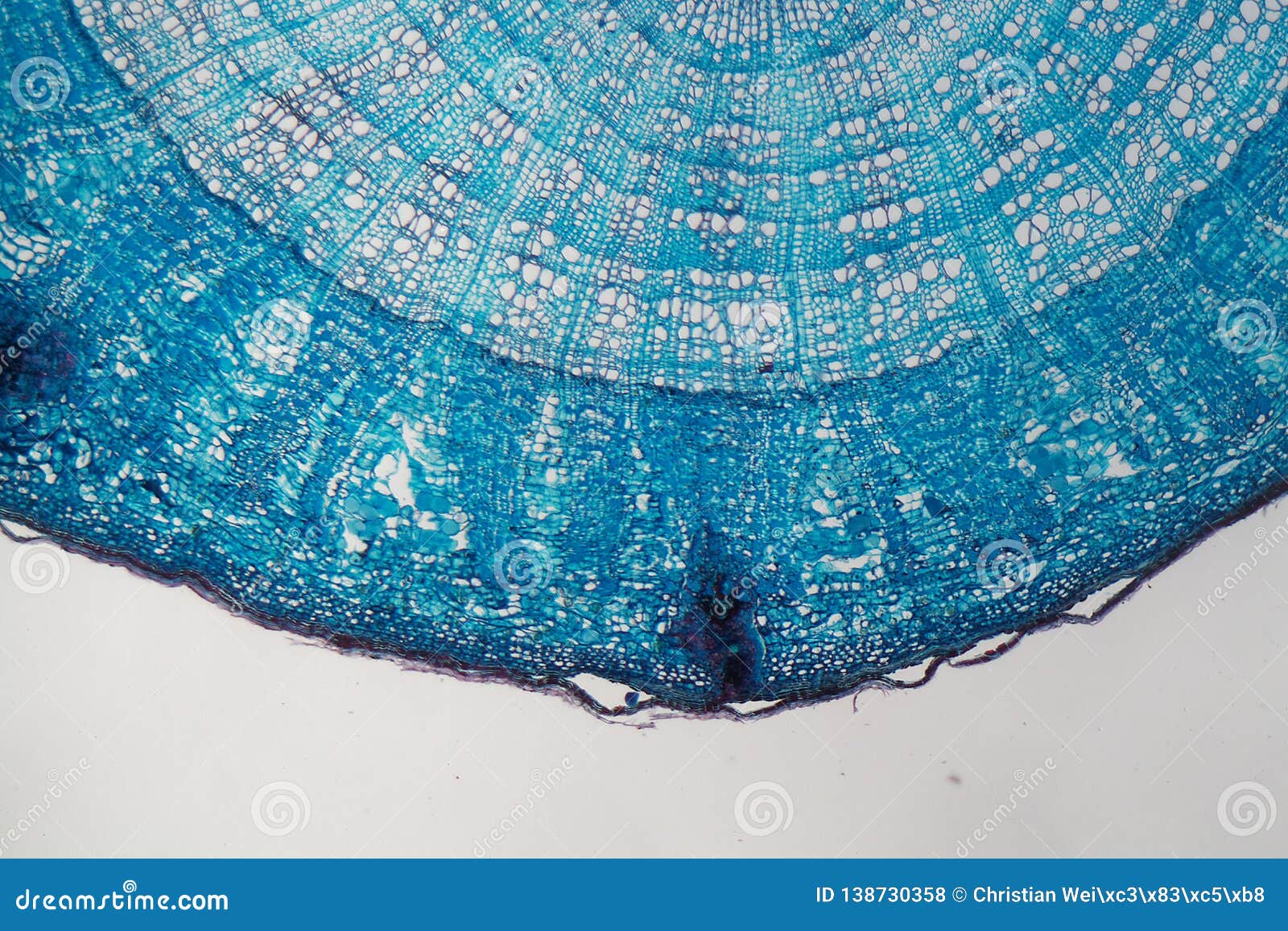 Cells Of A Plant Stem With A Disease Under A Microscope Royalty-Free ...