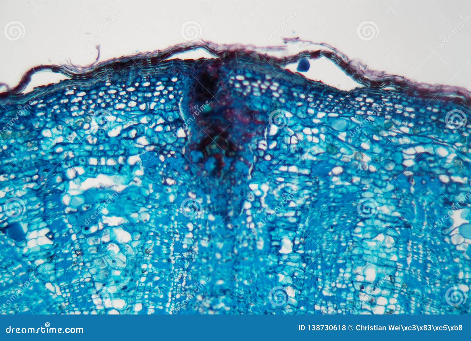 Cells of a Plant Stem with a Disease Under a Microscope Stock Photo ...