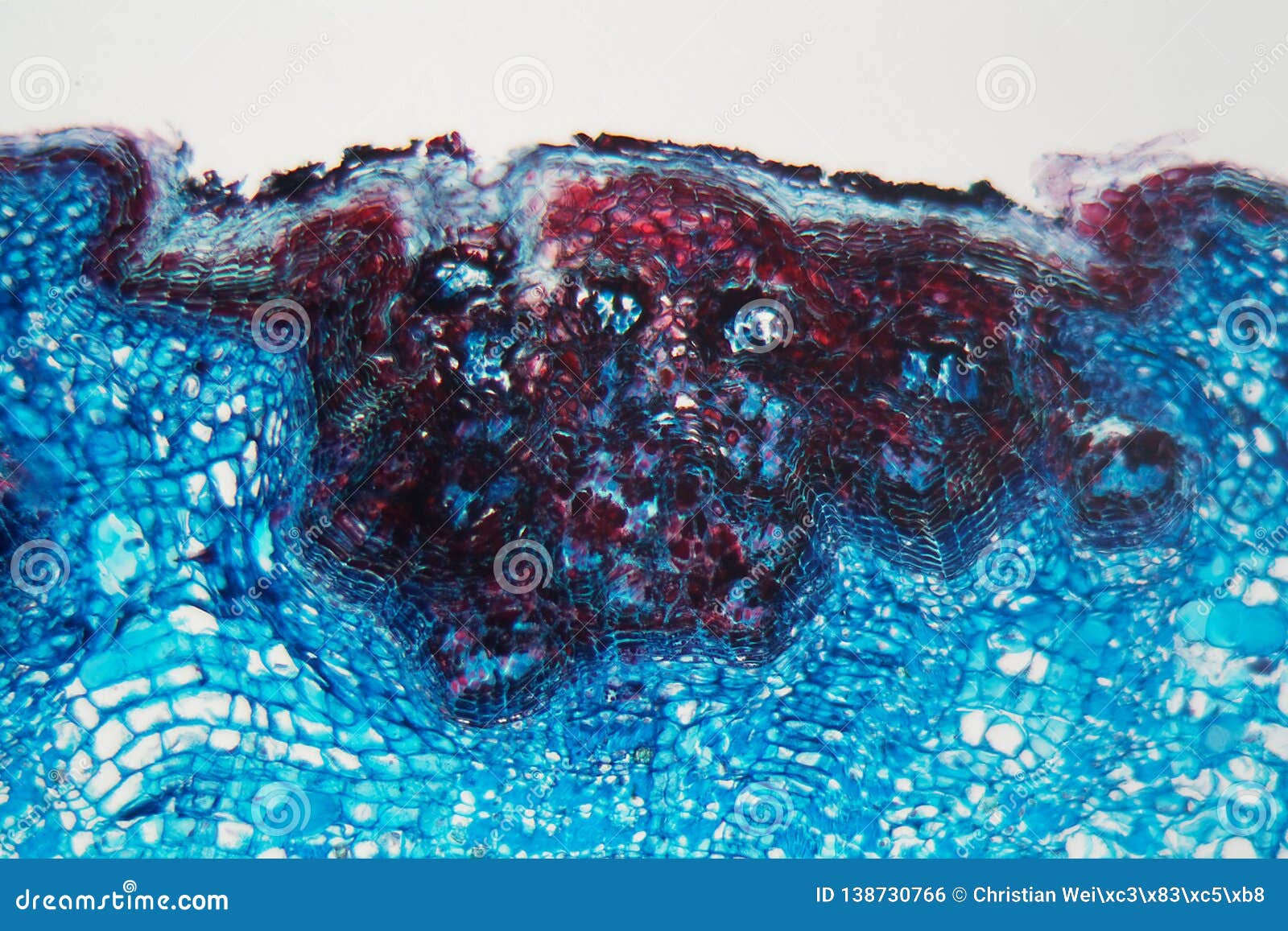Cells of a Plant Stem with a Disease Under a Microscope Stock Photo ...