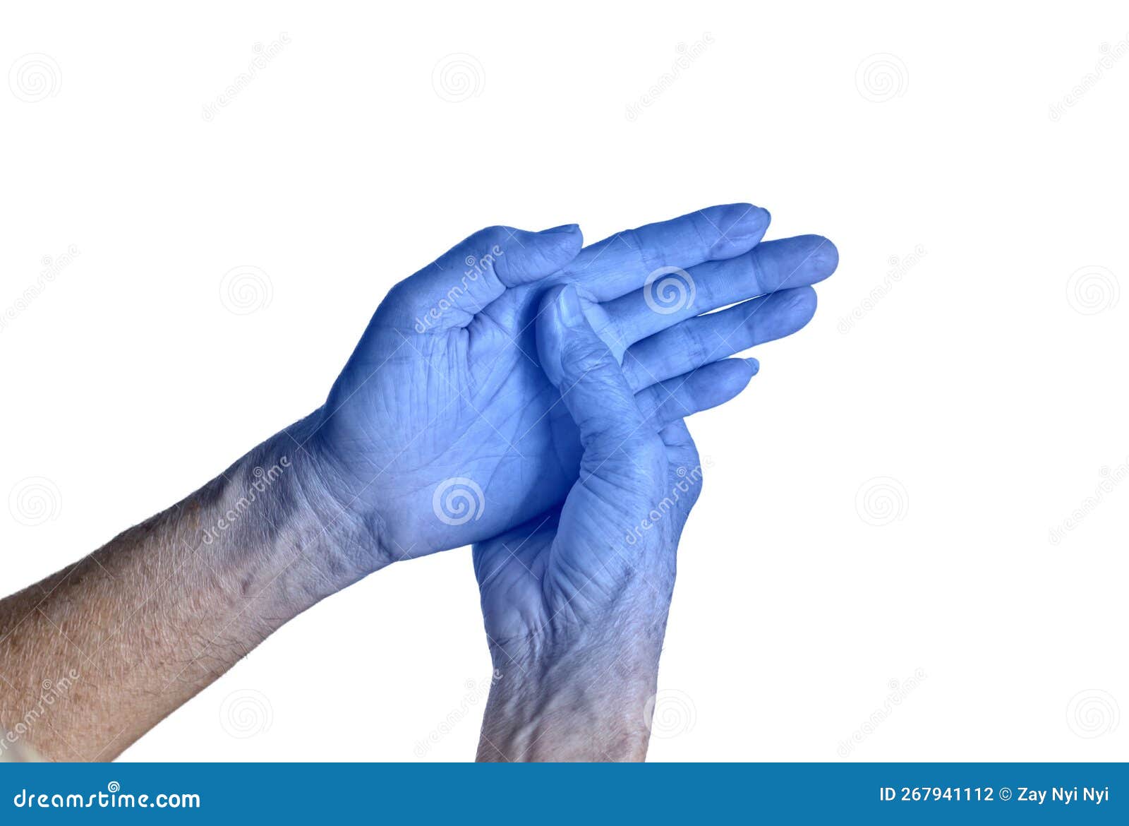 Blue Colored Hand of Asian Man. Concept of Cold and Clumsy Hand Stock ...