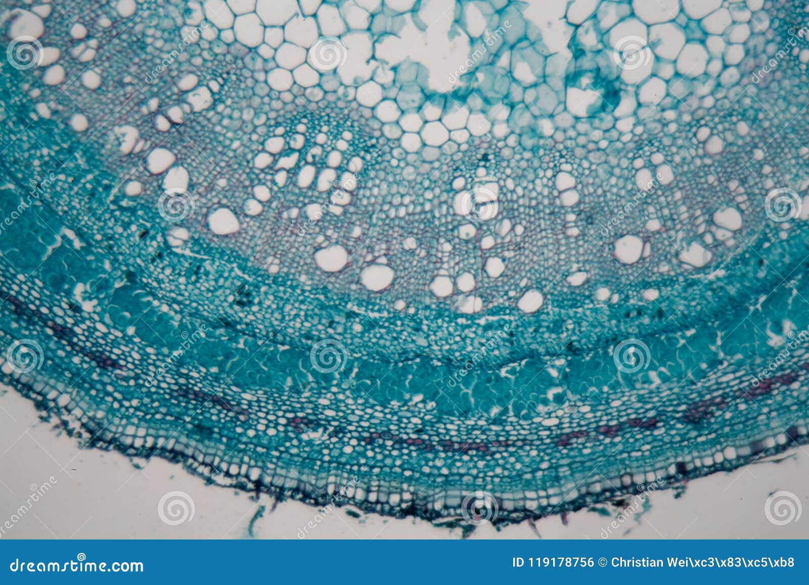 Stem Cells Of A Lentil Plant Under The Microscope. Stock Photo - Image ...