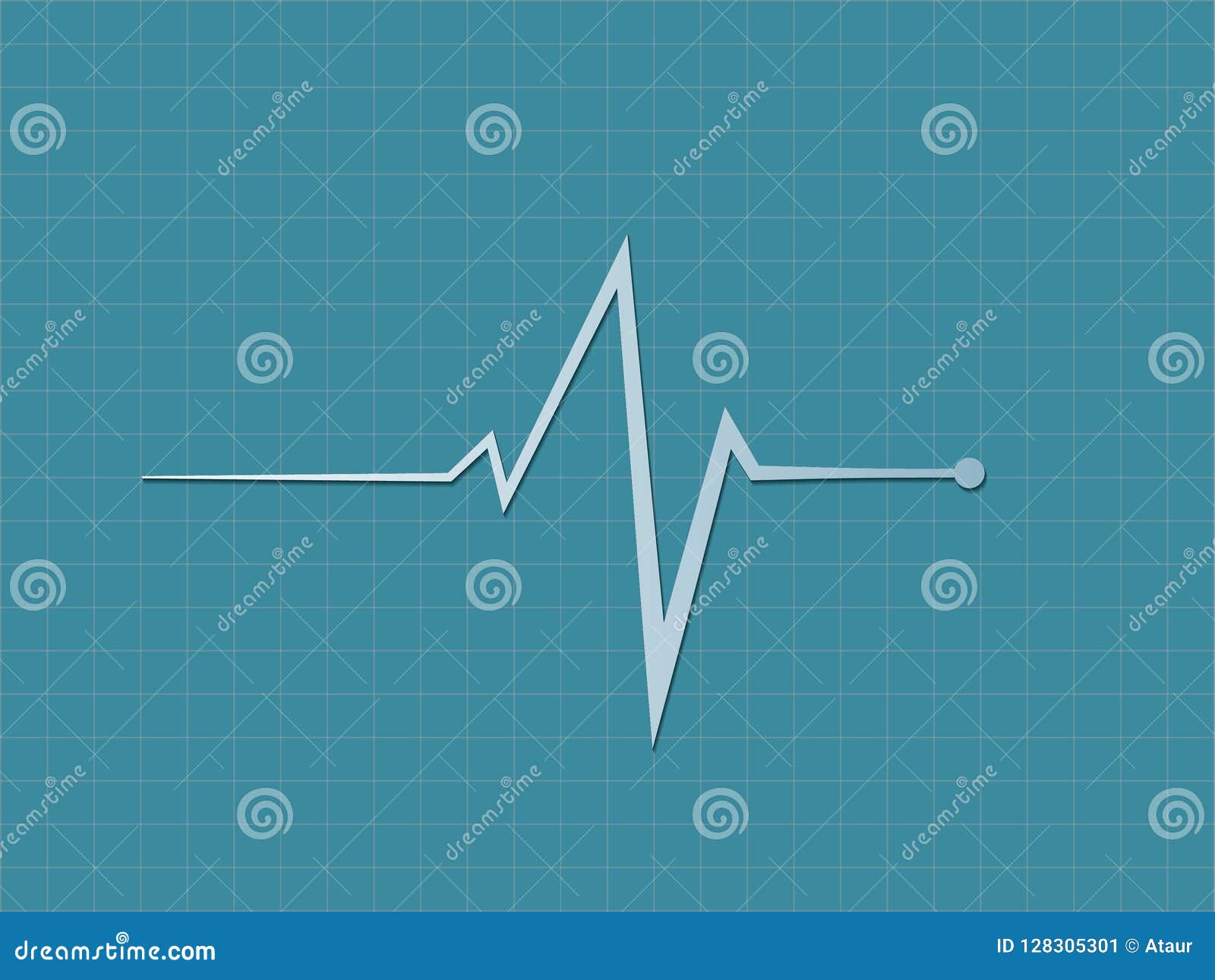 A Blue Heart Beat Sign Displaying in Cardiograph Monitor To Diagnosis ... A Blue Heart Beat Sign Displaying in Cardiograph Monitor To Diagnosis ...