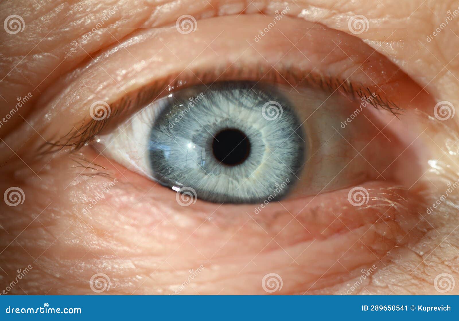 Blue Human Eye with Black Pupil Closeup. Stock Image - Image of disease ...