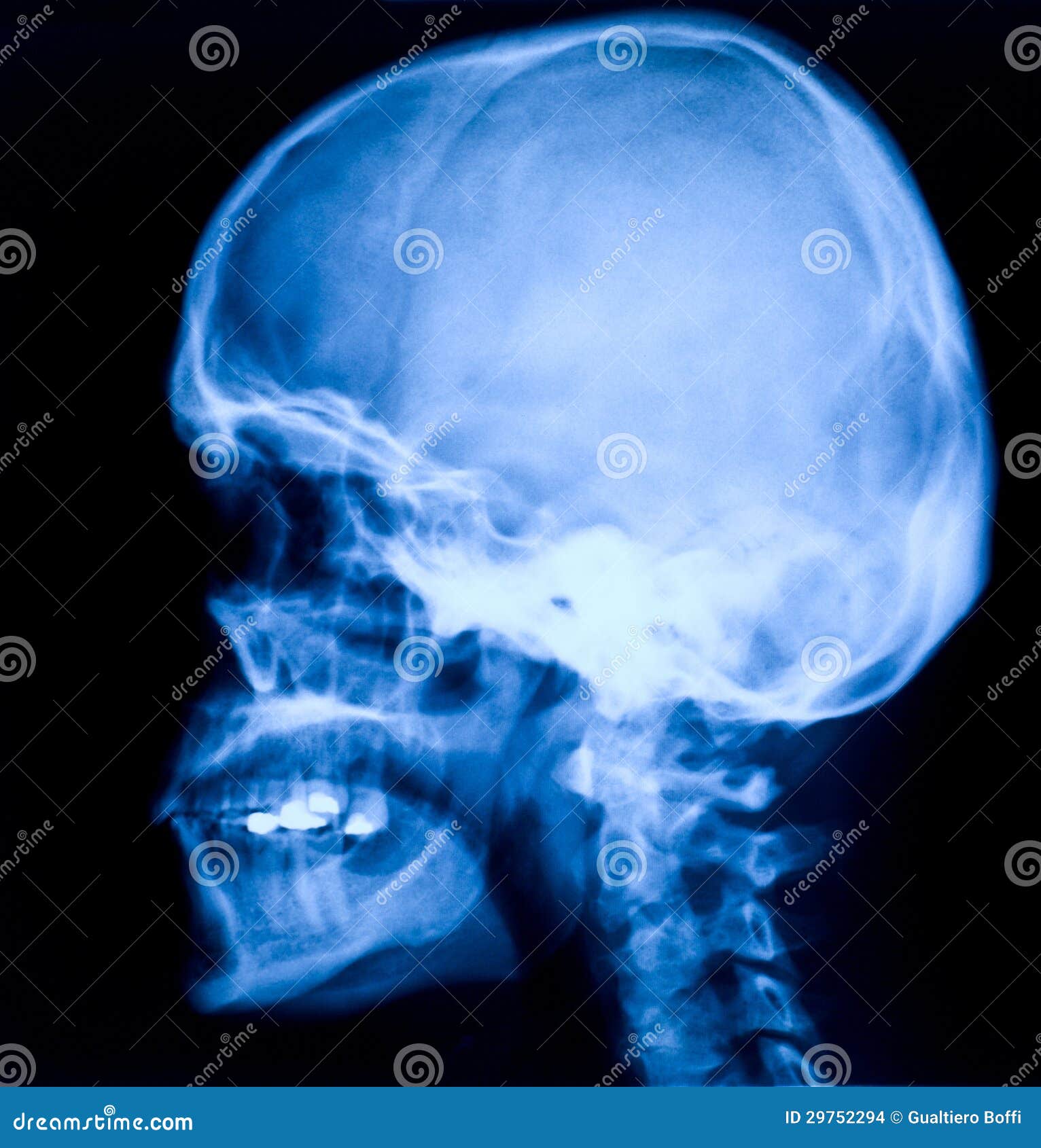 Head xray stock photo. Image of head, face, clinic, health - 29752294