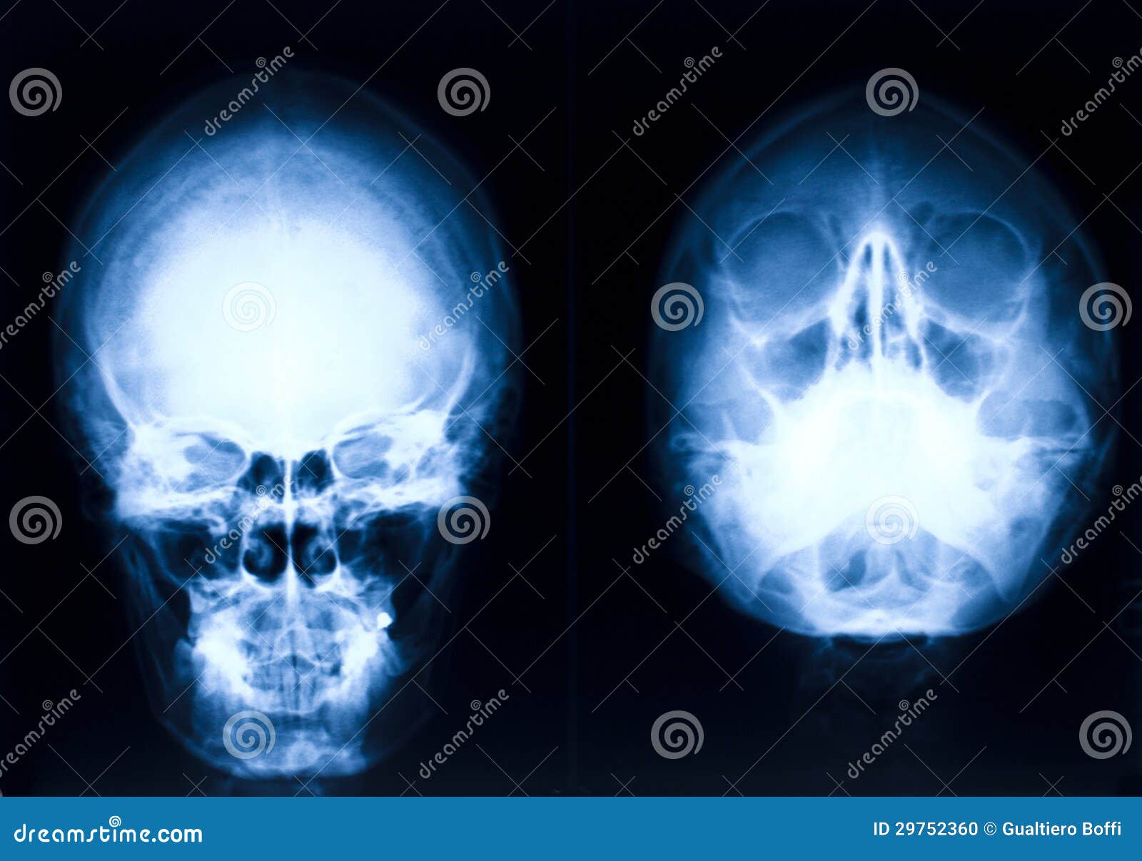 Head xray stock photo. Image of clinic, medicine, anatomy - 29752360