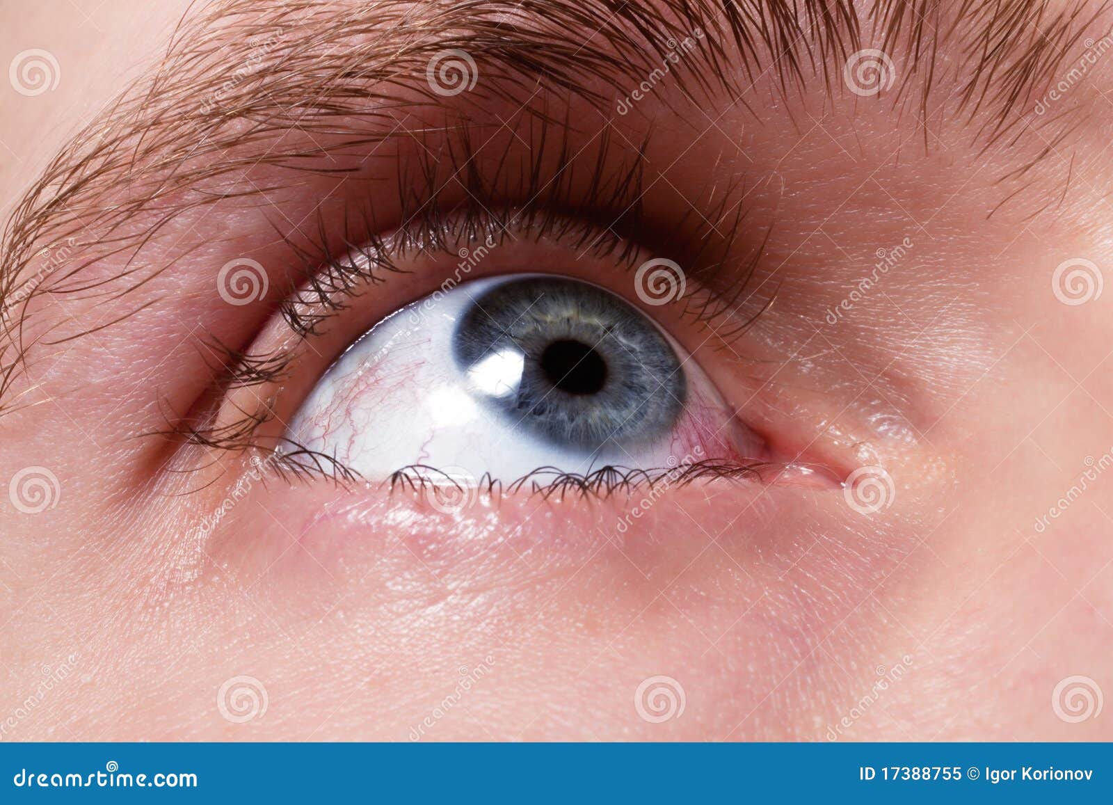 Blue Men Eye with Red Blood Vessels Stock Image - Image of blood, macro ...
