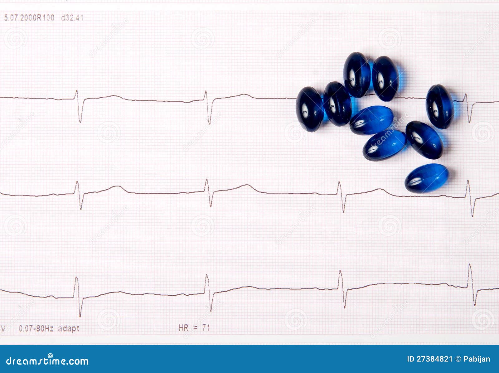 Blue Pills on ECG Chart (electrocardiogram) Stock Image - Image of beat ...