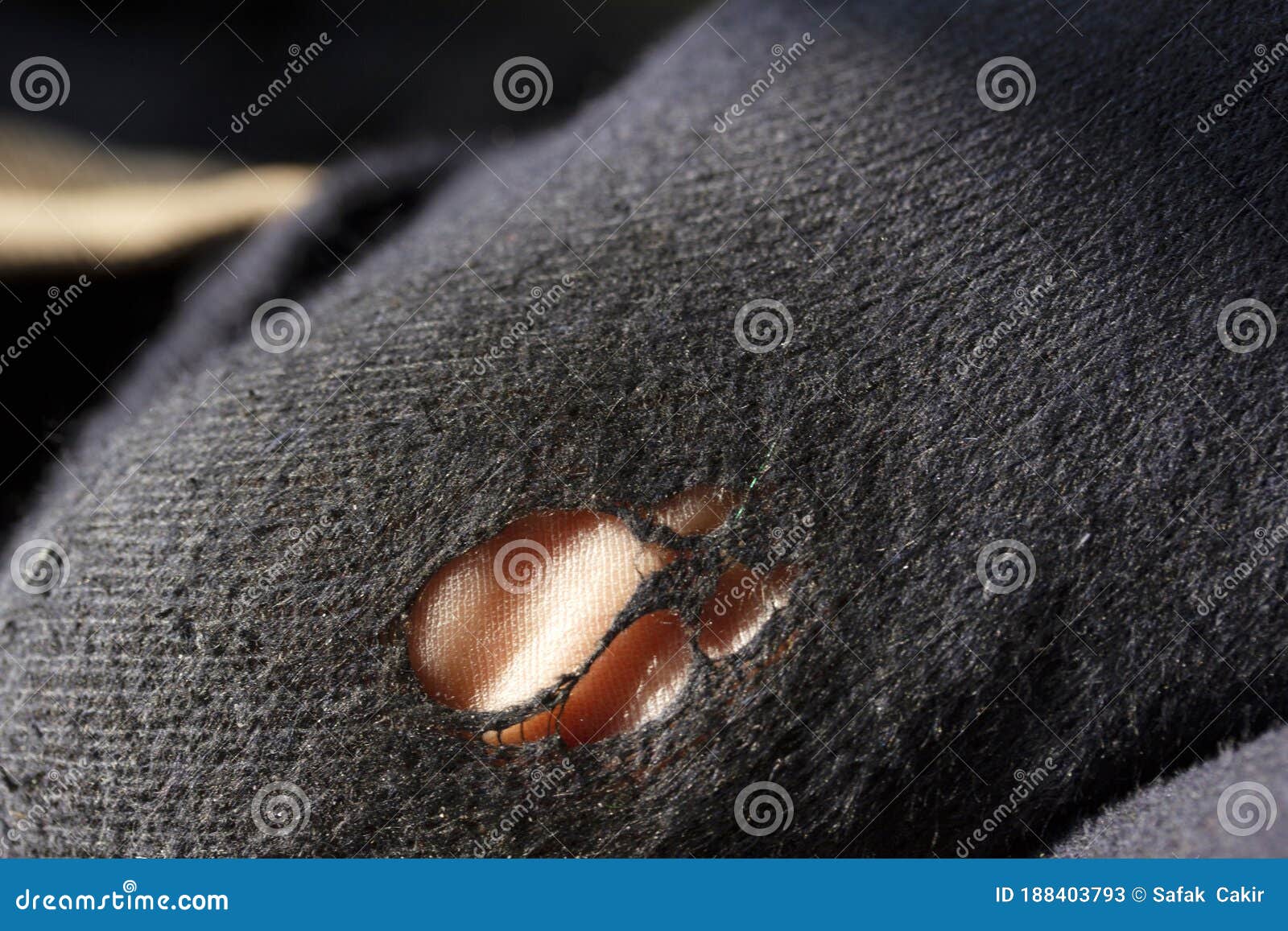 Blue Torn Socks. stock image. Image of heat, foot, damaged - 188403793
