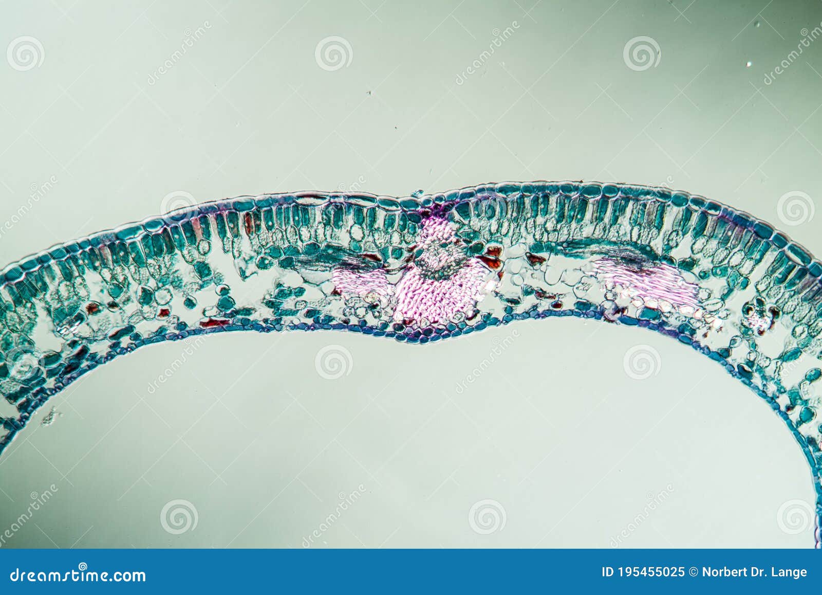 Blueberry Leaf Cross Section Under the Microscope, Stock Image - Image ...