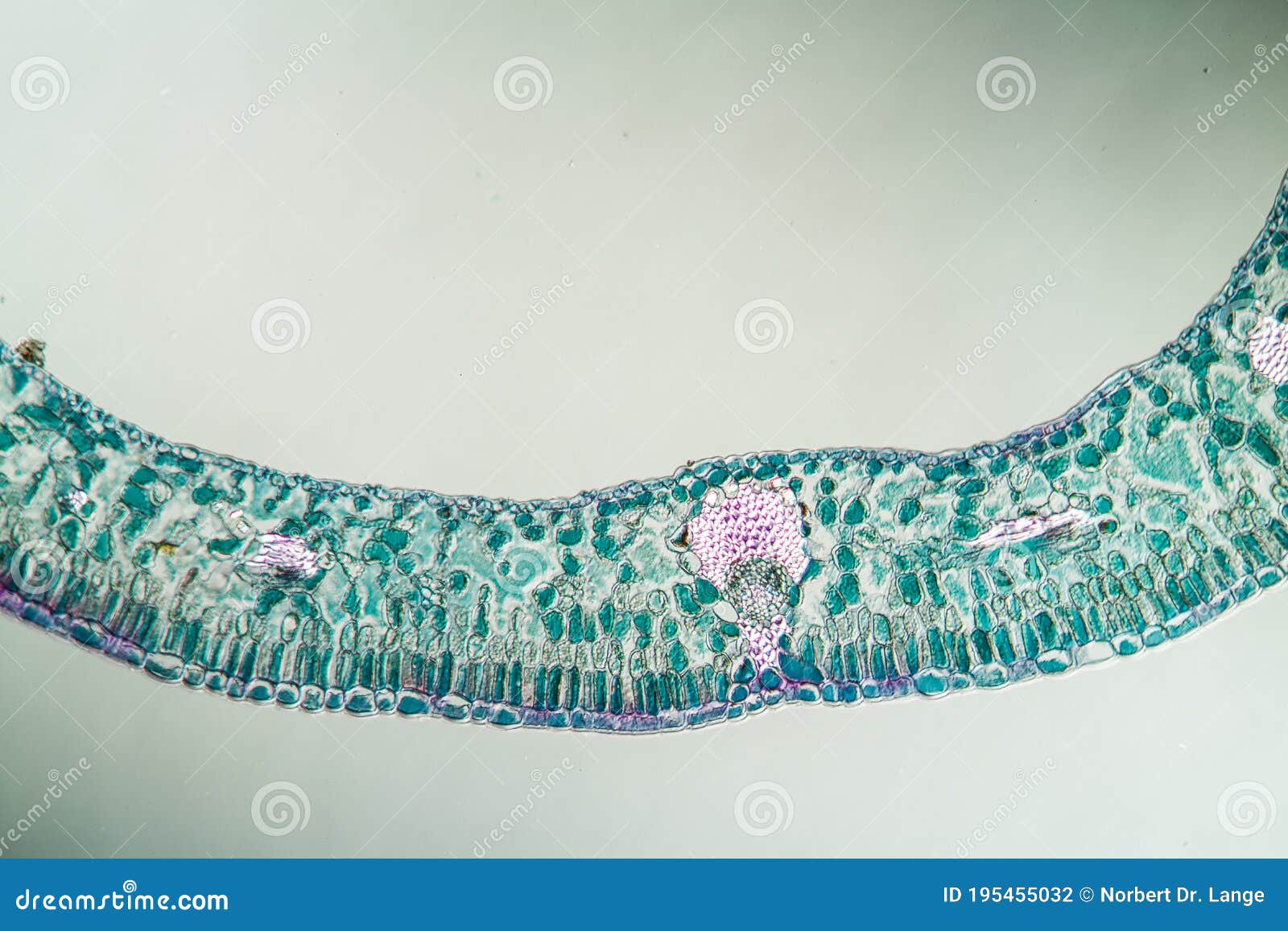 Blueberry Leaf Cross Section Under the Microscope, Stock Photo - Image ...