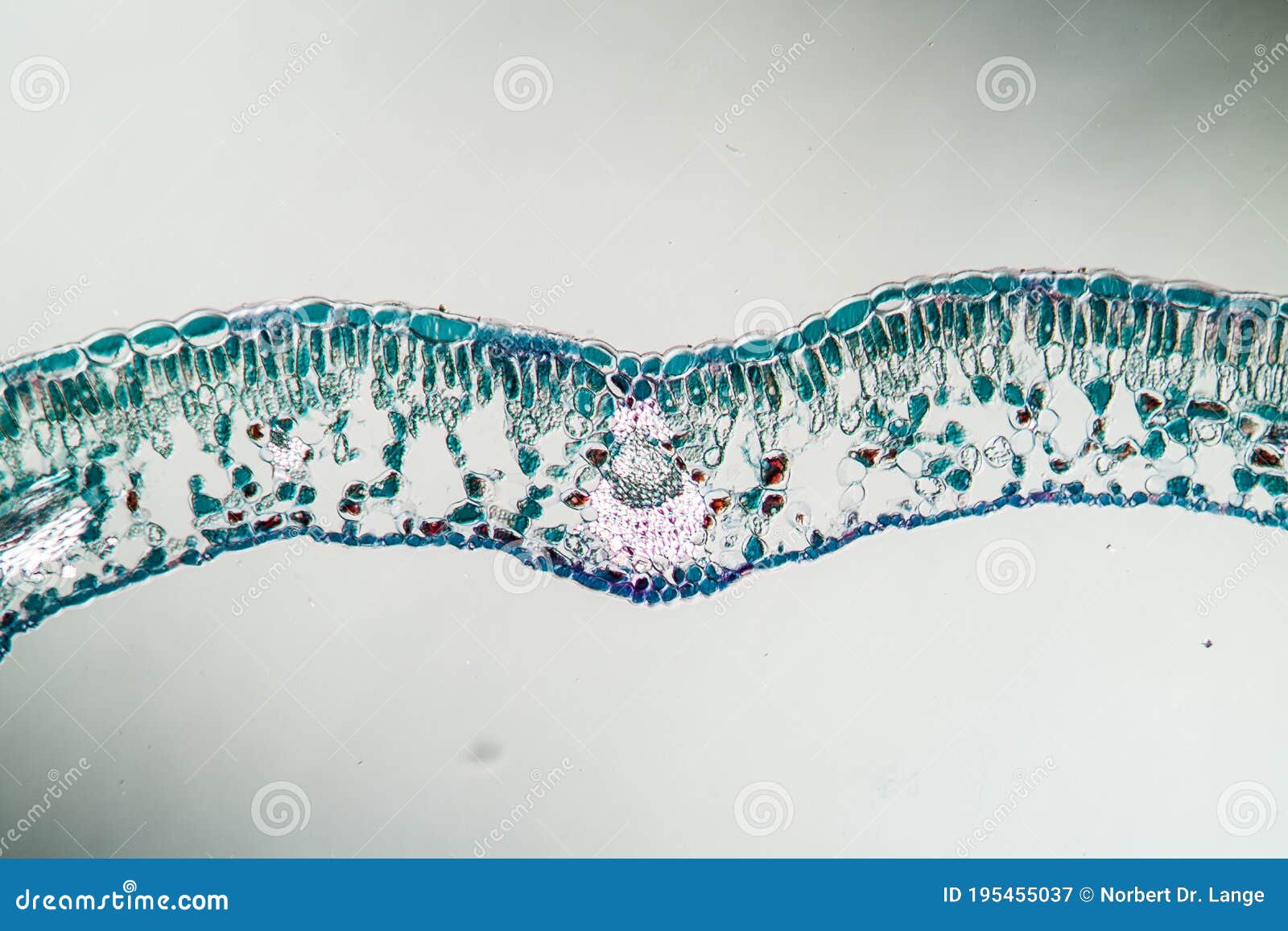 Blueberry Leaf Cross Section Under the Microscope, Stock Image - Image ...