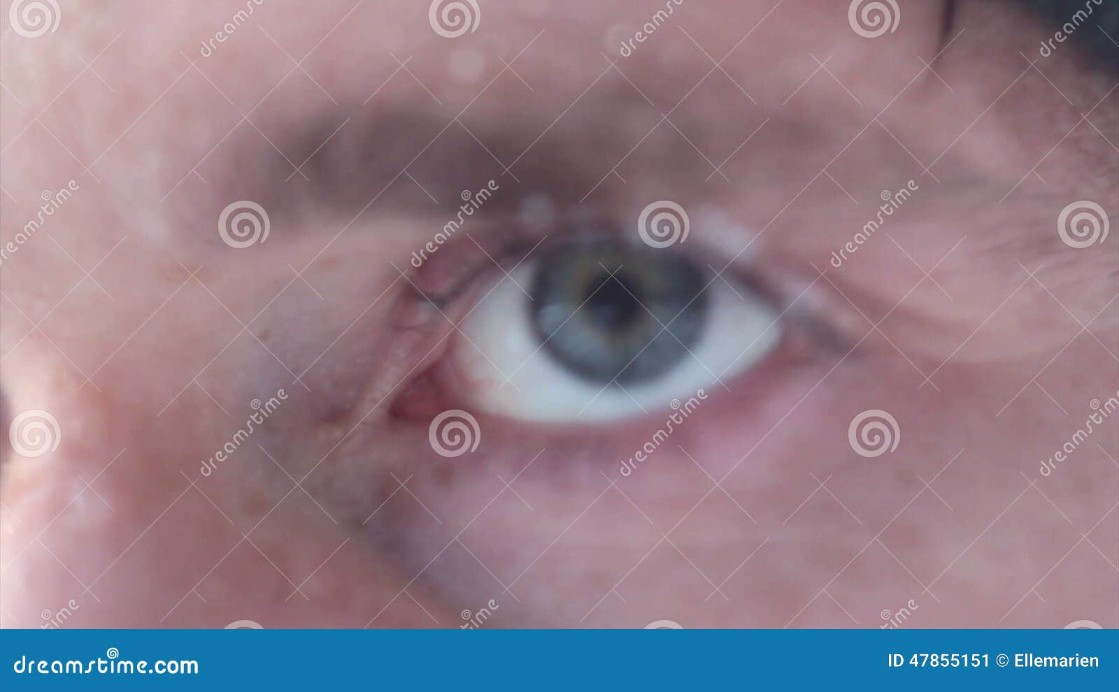 Frostbite Stock Footage & Videos - 234 Stock Videos