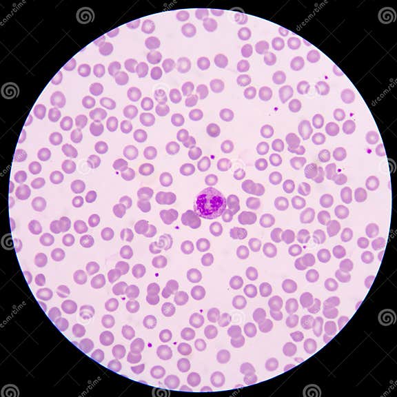 Blutausstrich stock abbildung. Illustration von hämatologie - 65634761